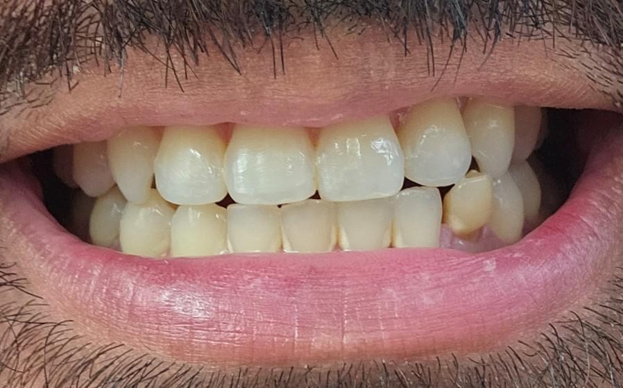 Finished! | Scrolller