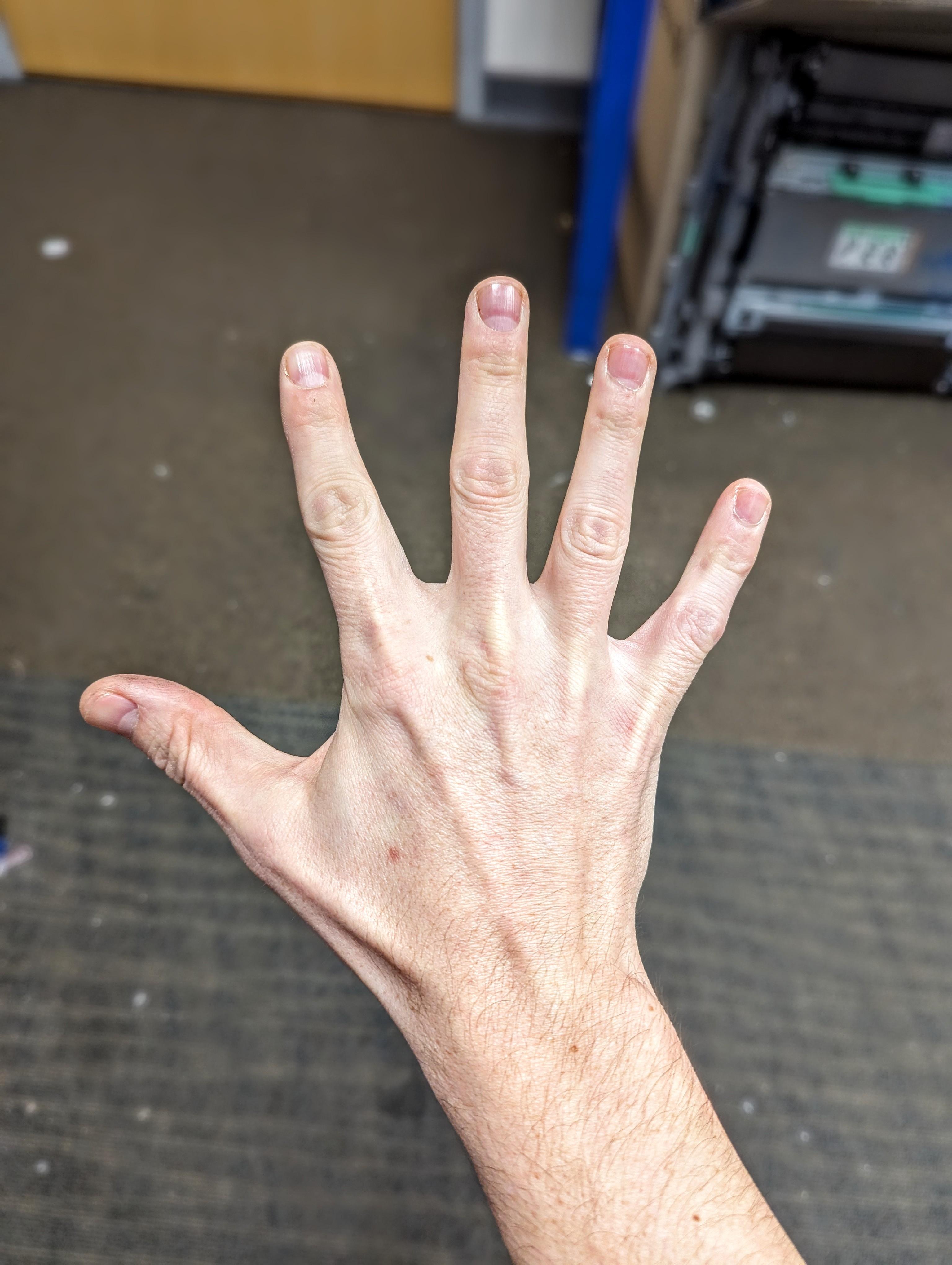 Do you prefer the front or the palm best? | Scrolller