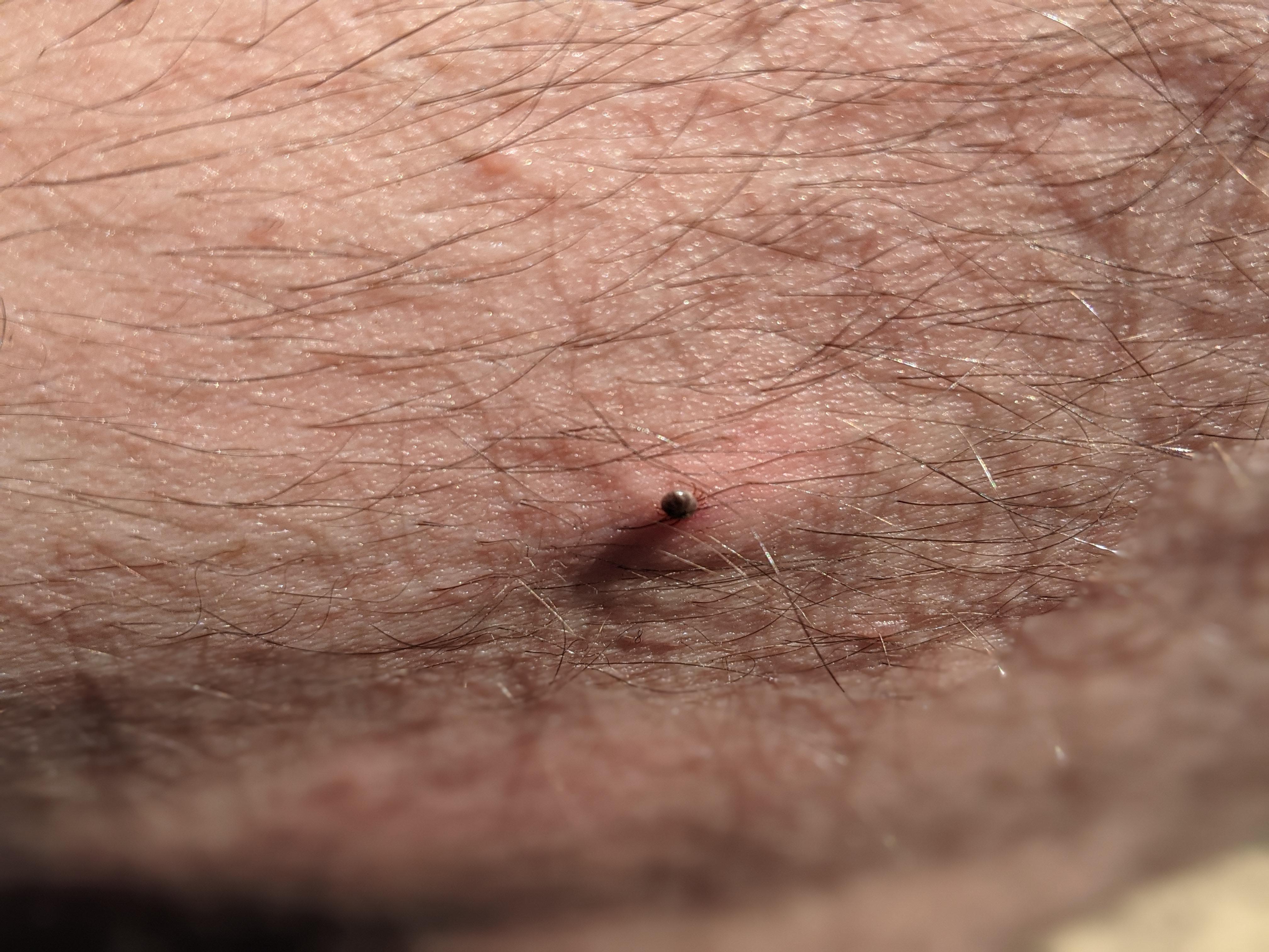 What type of tick is this? | Scrolller