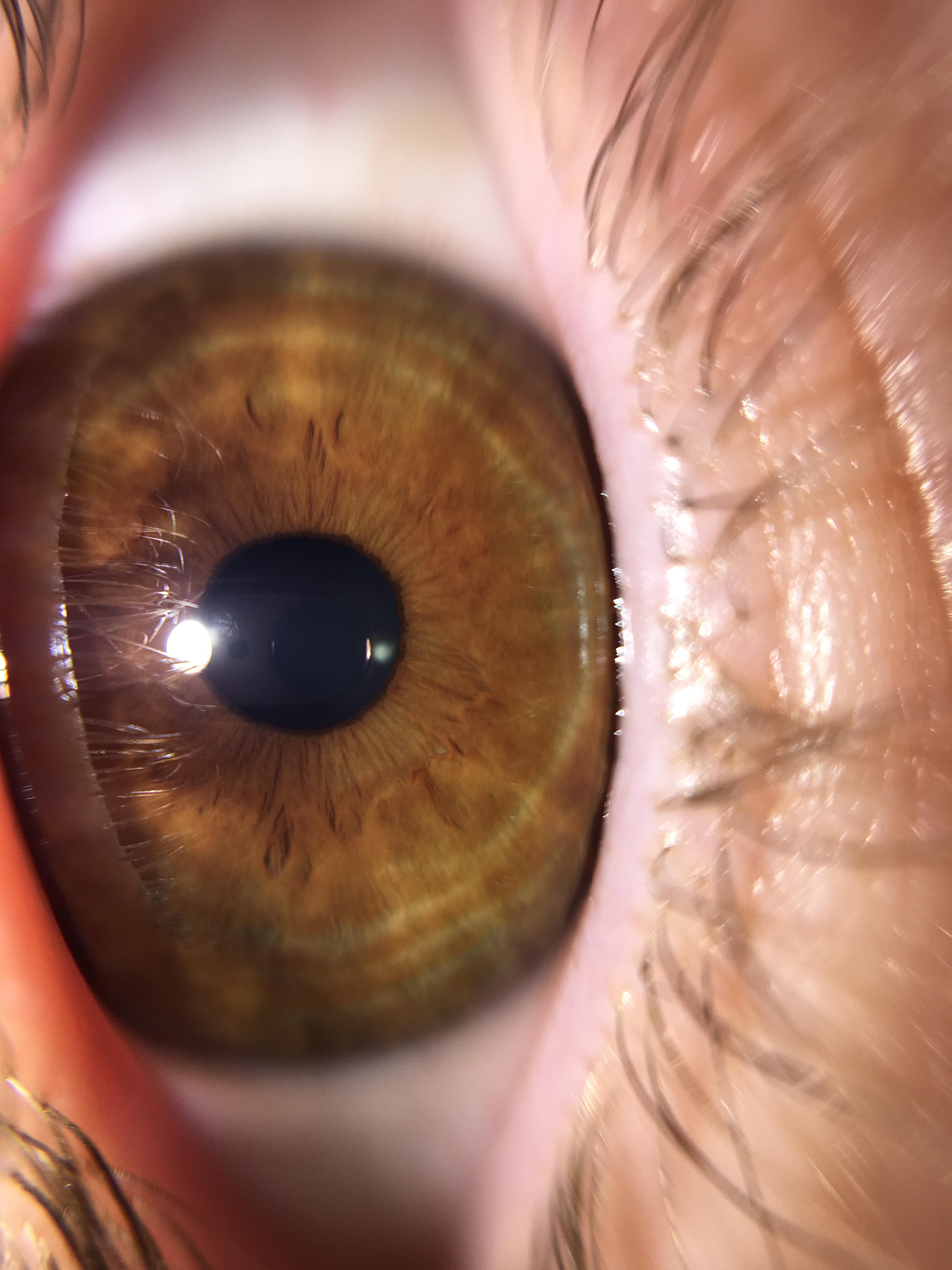 Close up I took a few years ago. Would these be considered hazel ...