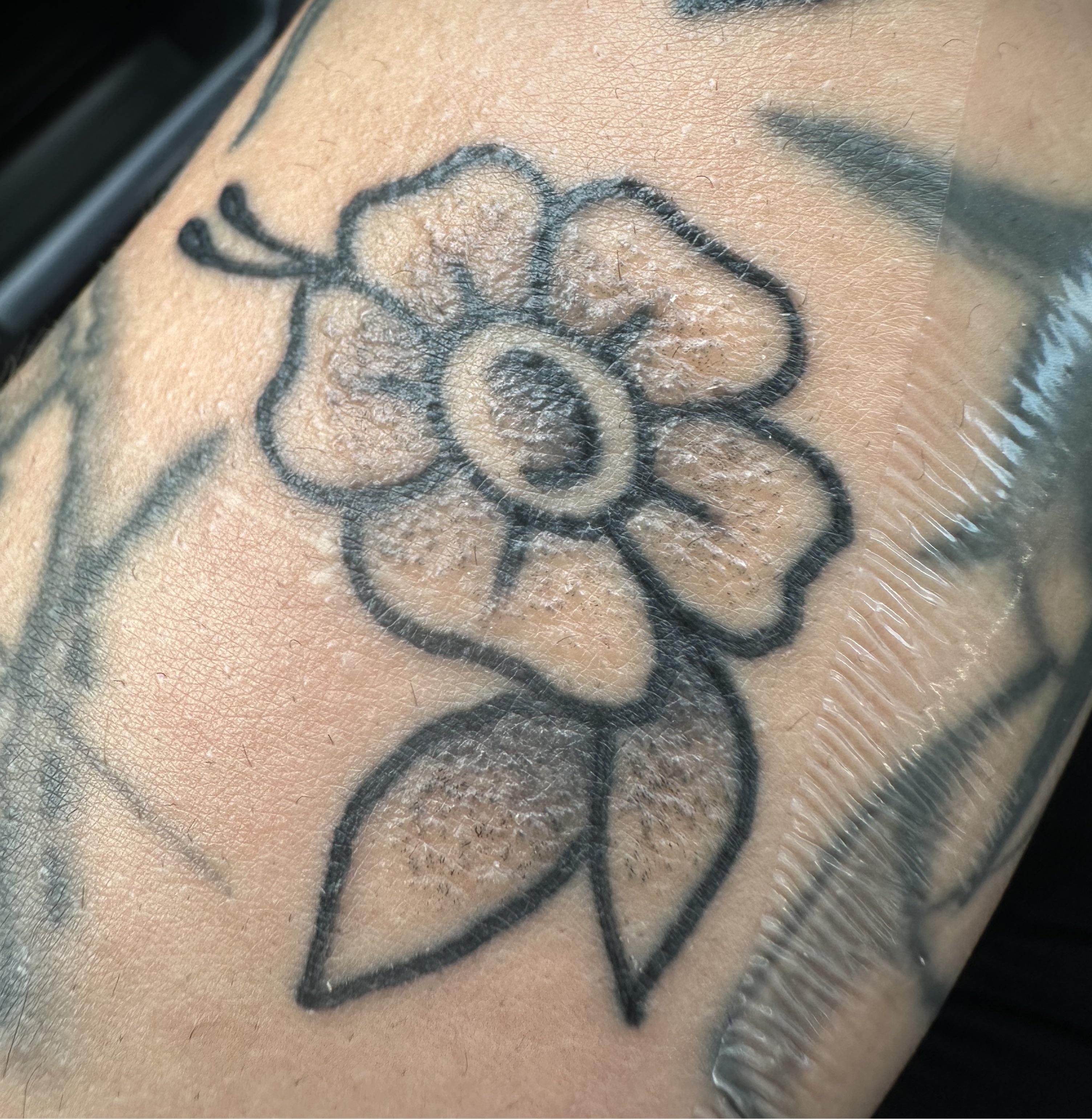 Start of an infection? | Scrolller