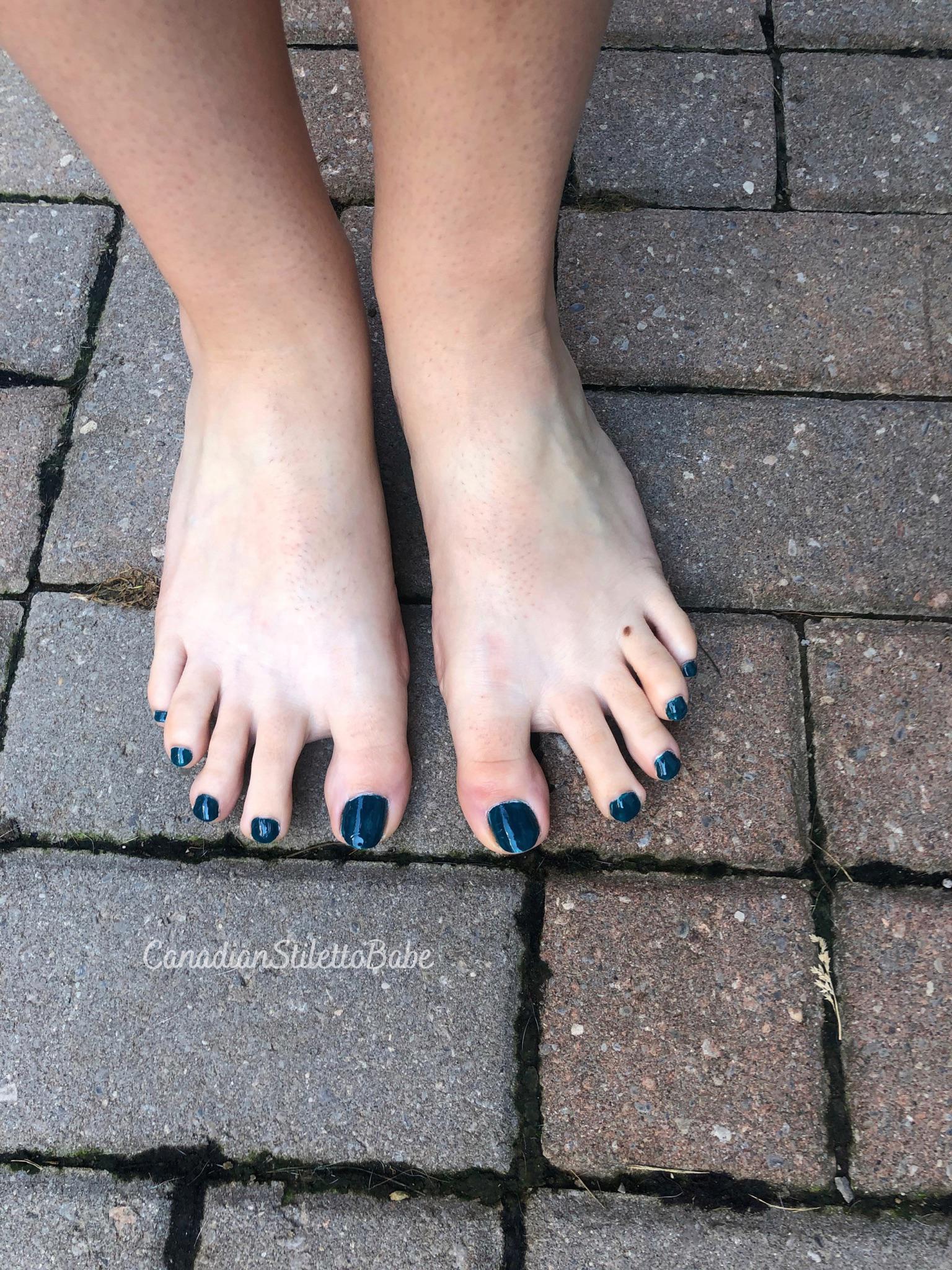 Teal toes | Scrolller