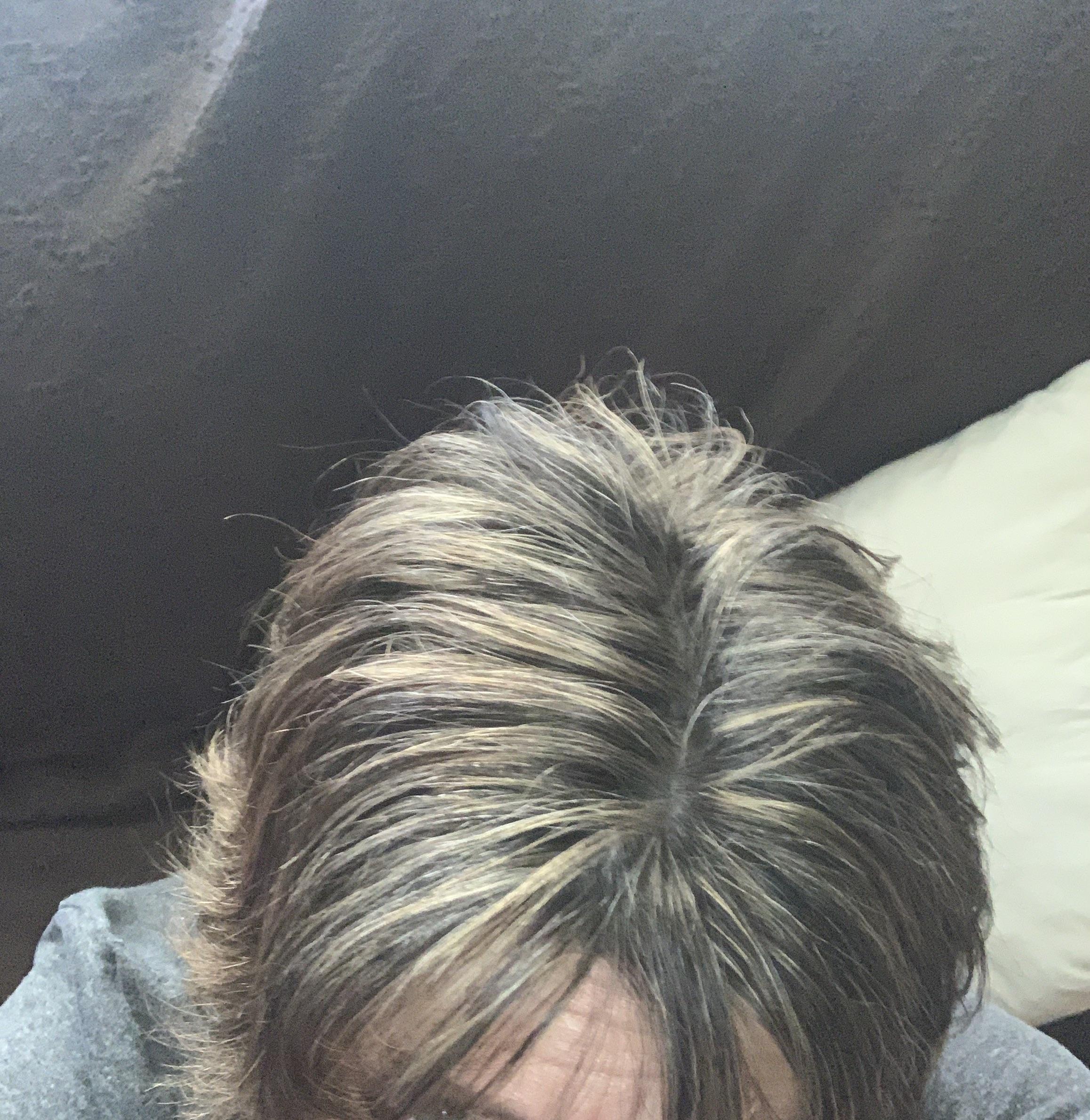 Foil nightmare!! | Scrolller