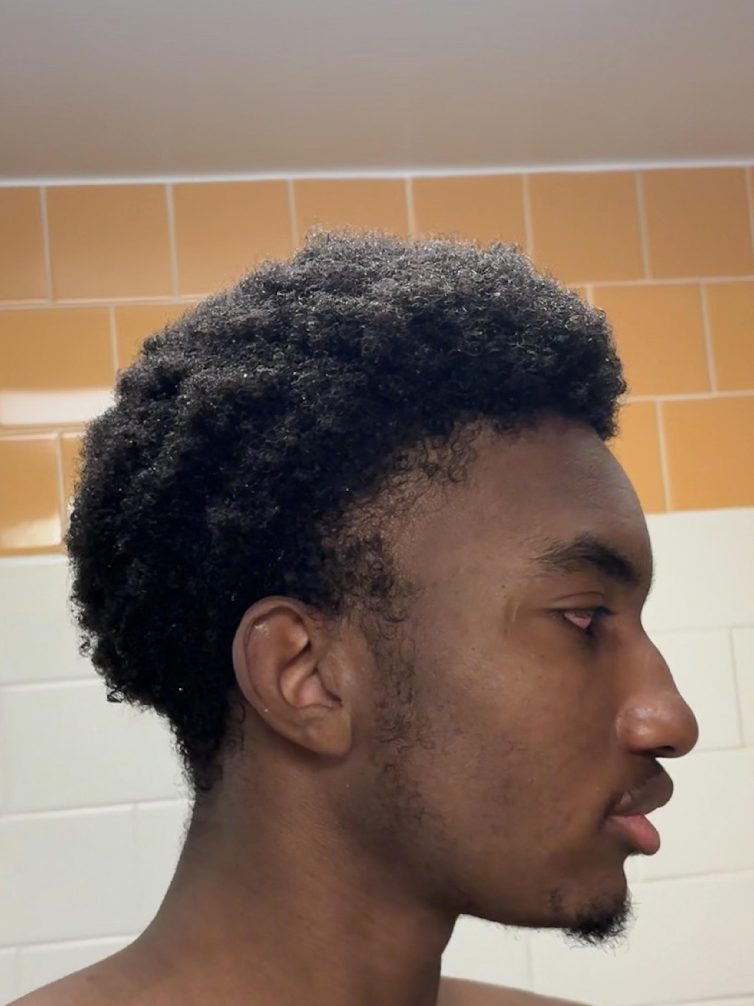 Any hair growth tips? | Scrolller