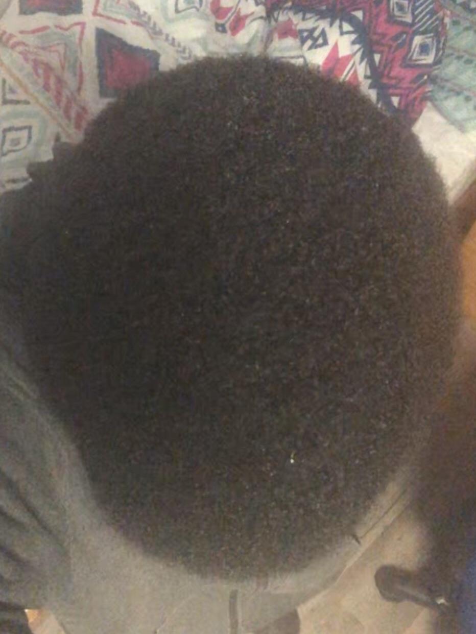 Discover more like BlackHair: Hiding small bald spots on Afro and Related Content | Scrolller
