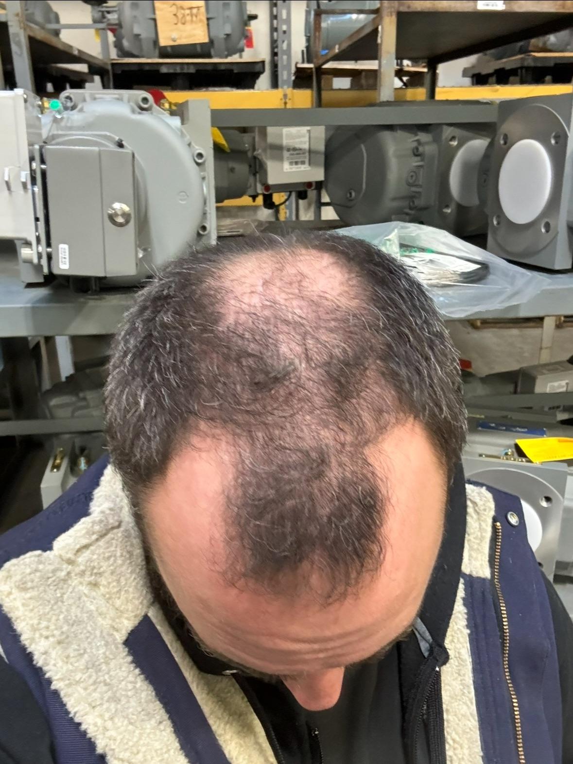 Been Growing My Hair Back Out Since Oct. From Full Shave | Scrolller