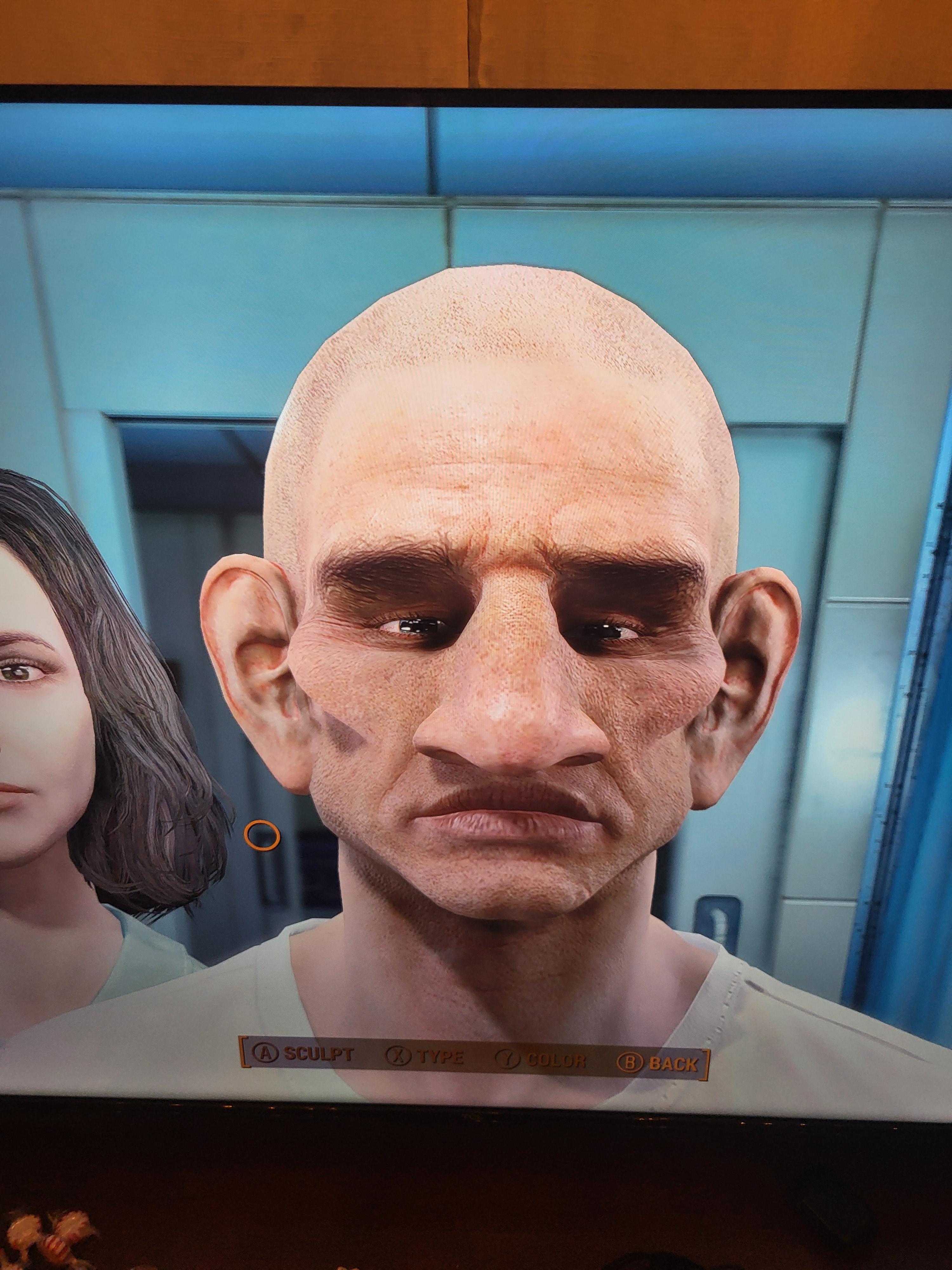 Update on Cheekbone Charles Jr. III | Scrolller