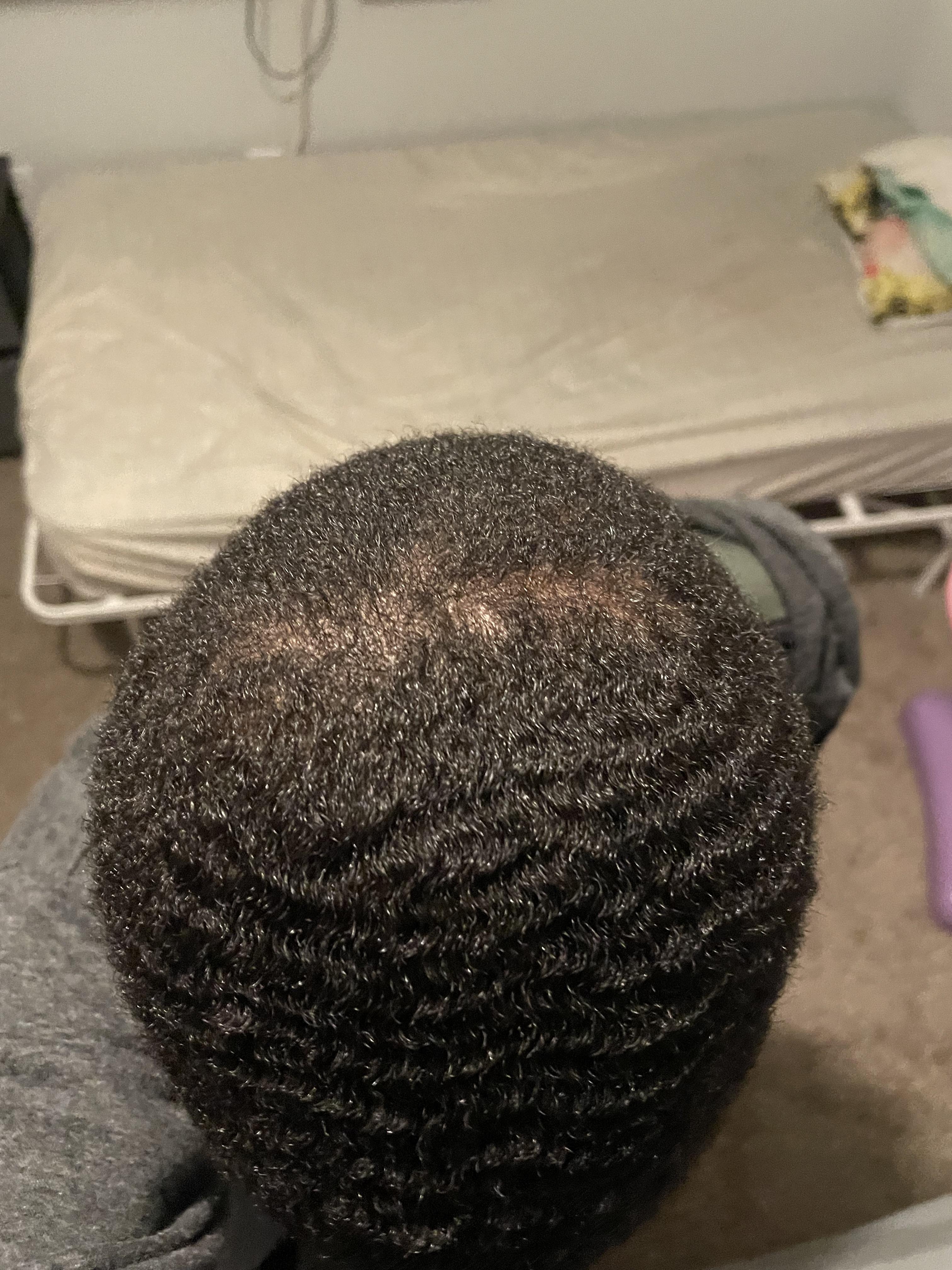 Can someone tell me what my hair type is and if I can get waves | Scrolller