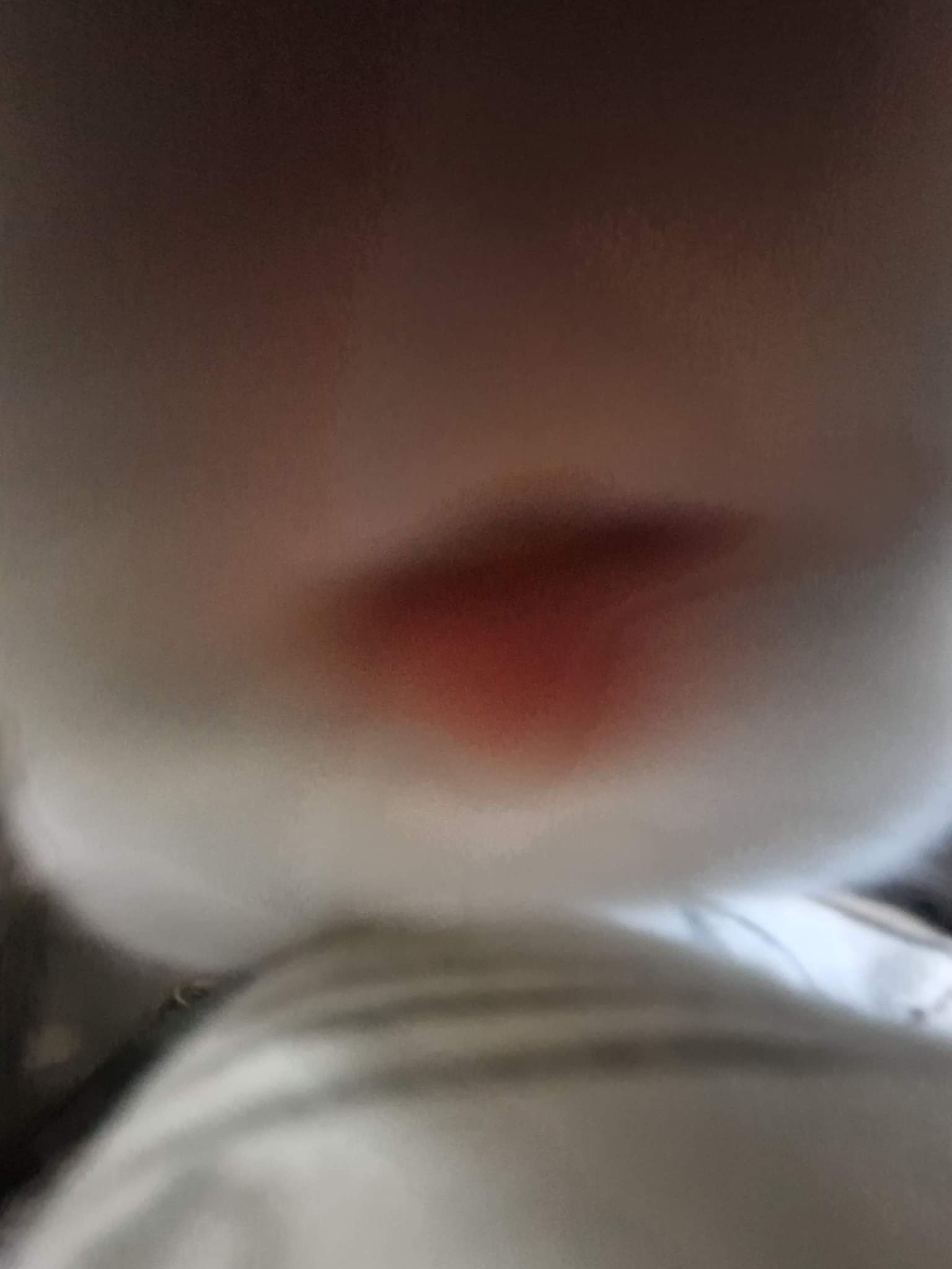 Pls enjoy cursed photos of Pinto Bean's lips (and his chicken legs ...