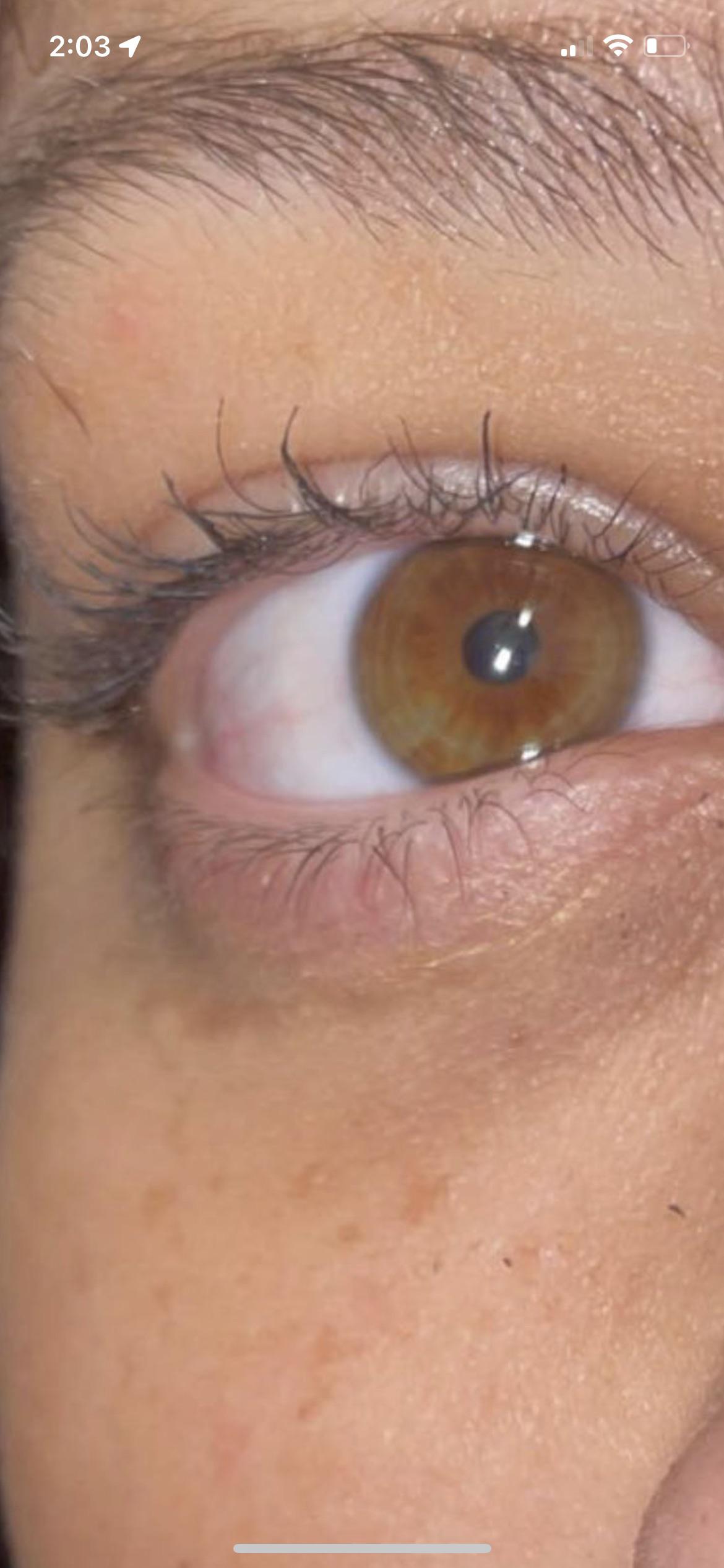 Eye patterns | Scrolller