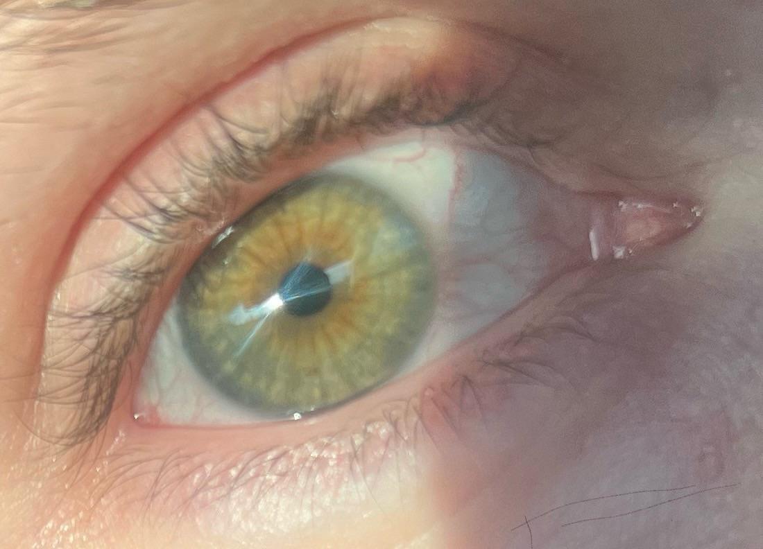 Green or hazel? | Scrolller