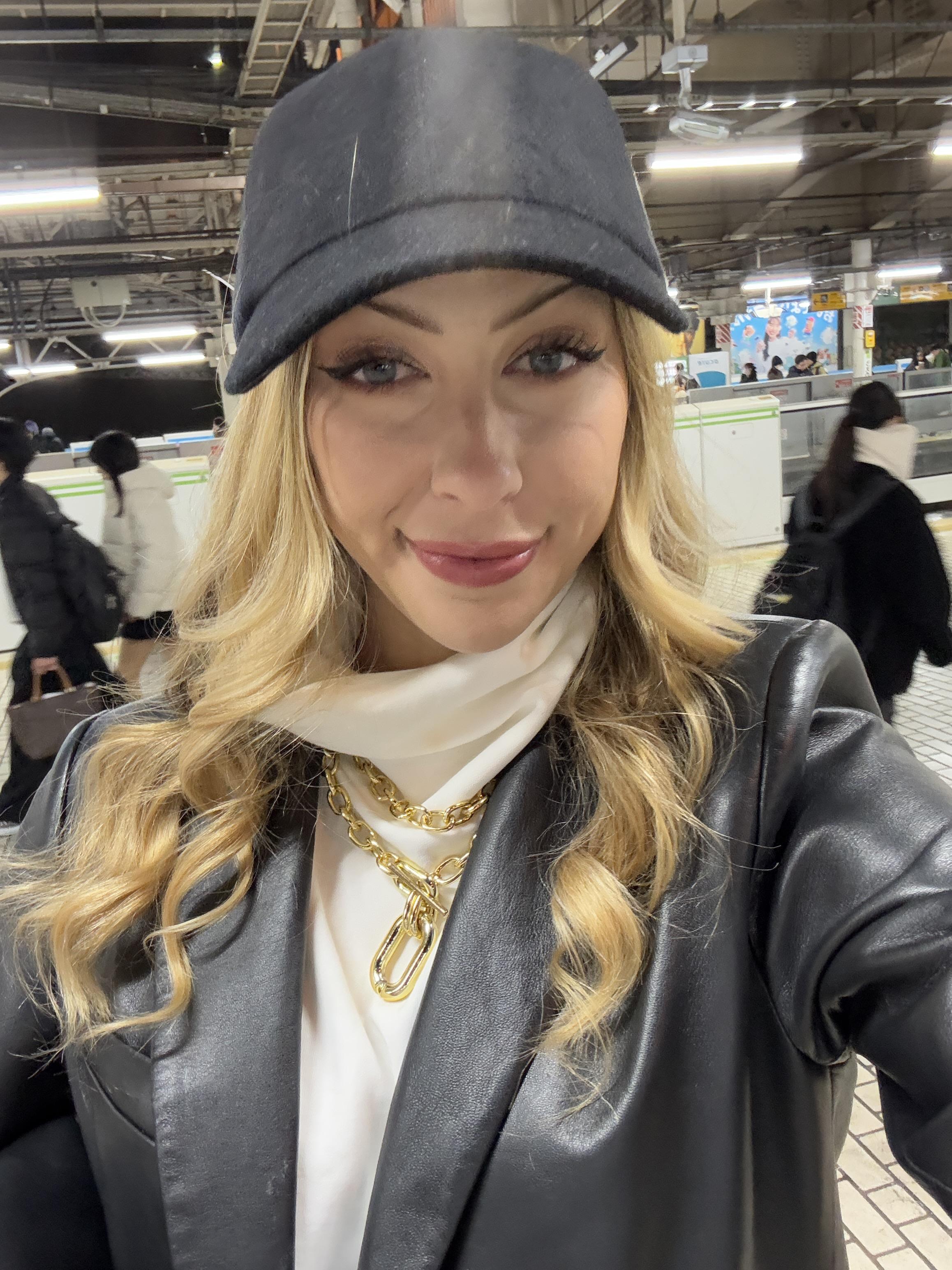 Orbital bone showing. How to fix? | Scrolller