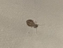 Please help!! Is this bedbug?? | Scrolller