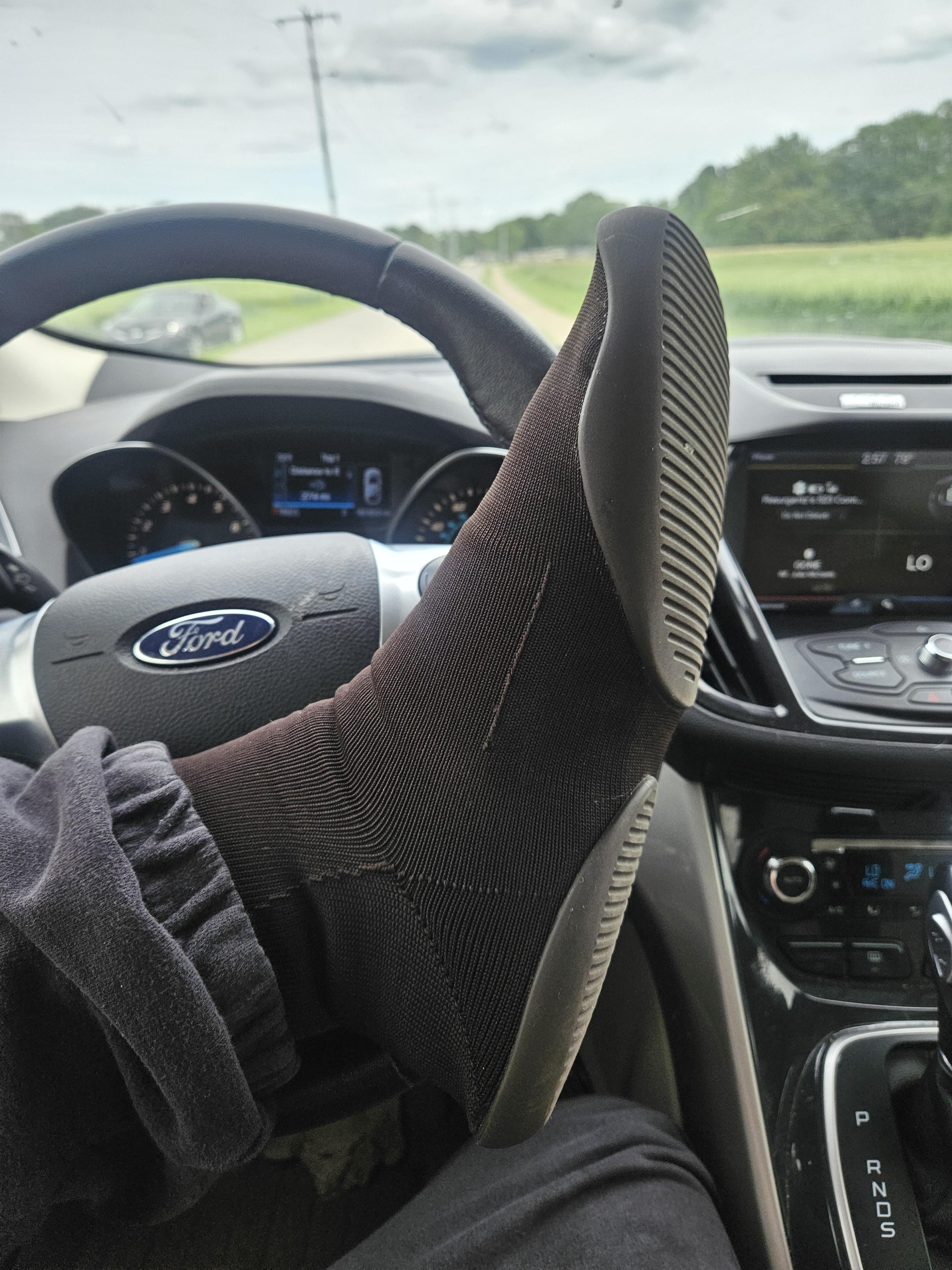 Is this normal? | Scrolller