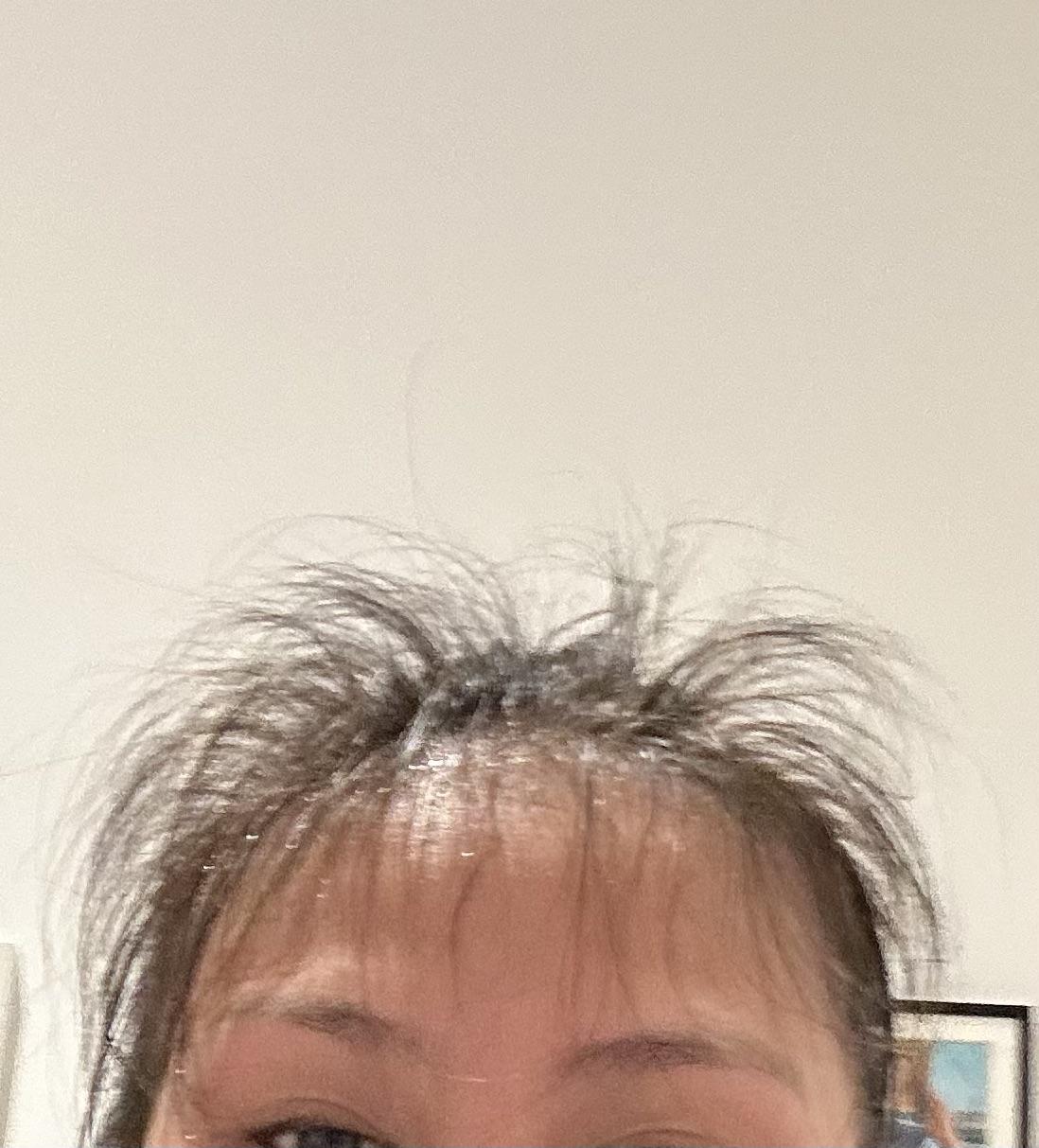 Hair breakage | Scrolller