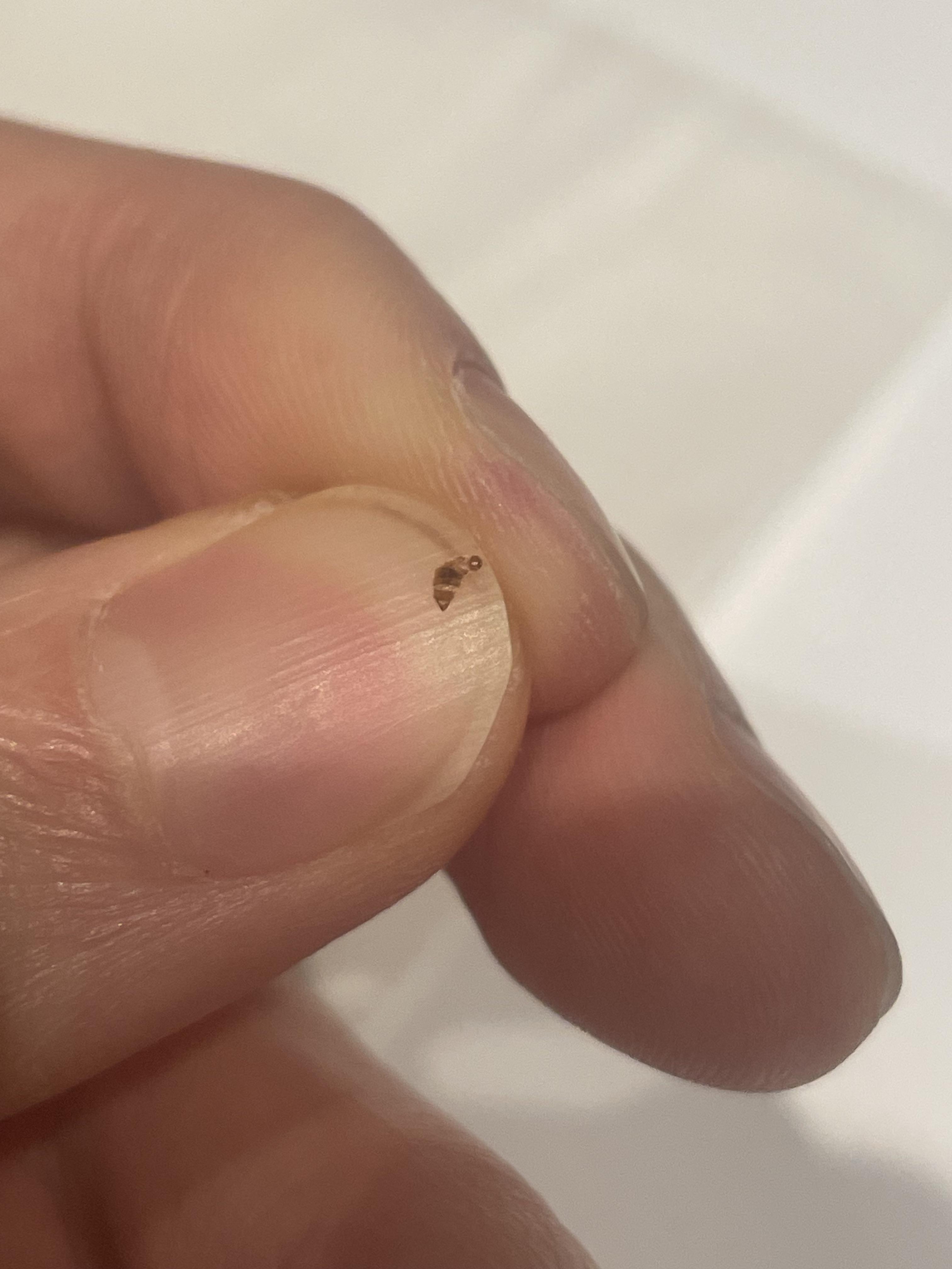 Bug casing/Shedding? | Scrolller