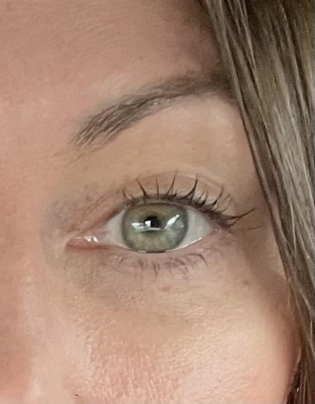 So confused | Scrolller