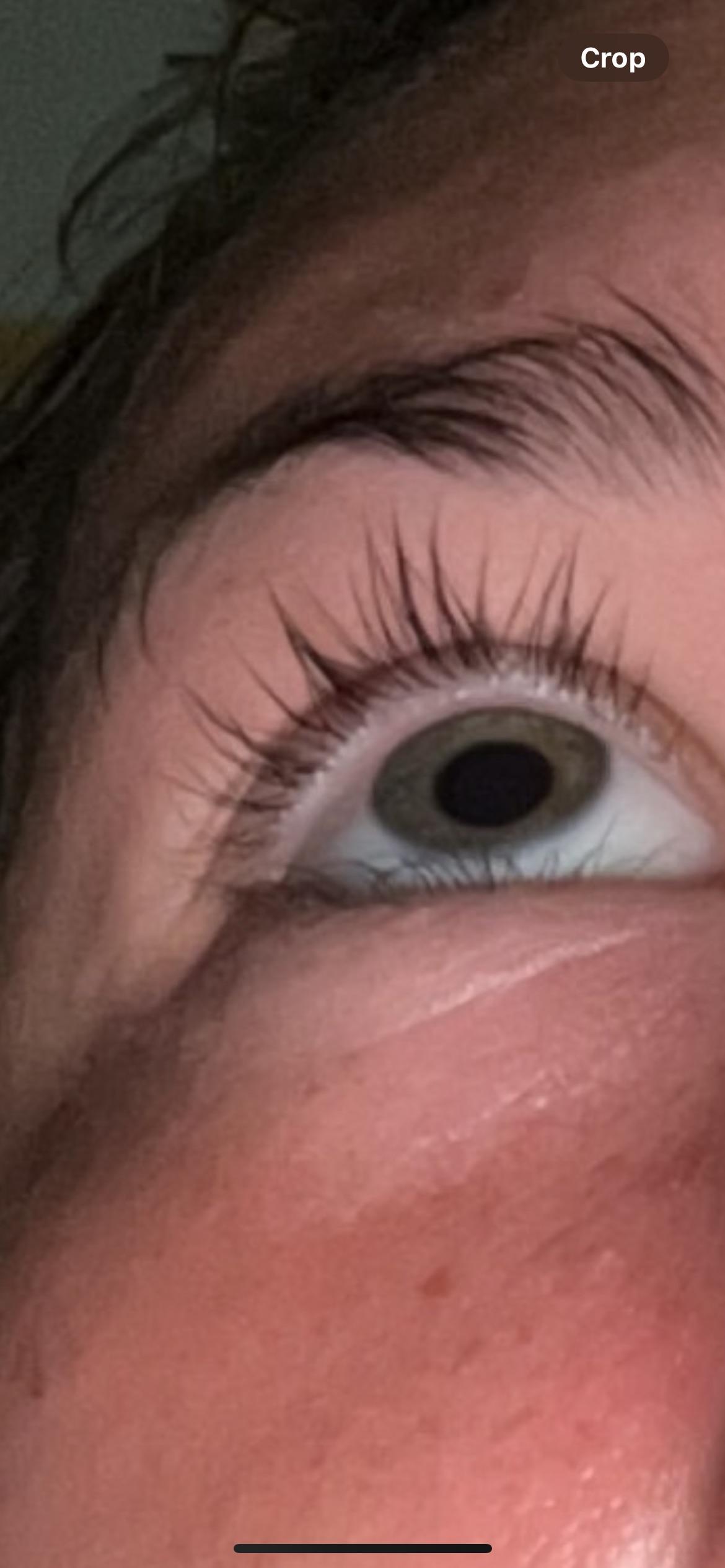 Eyelashes falling out | Scrolller