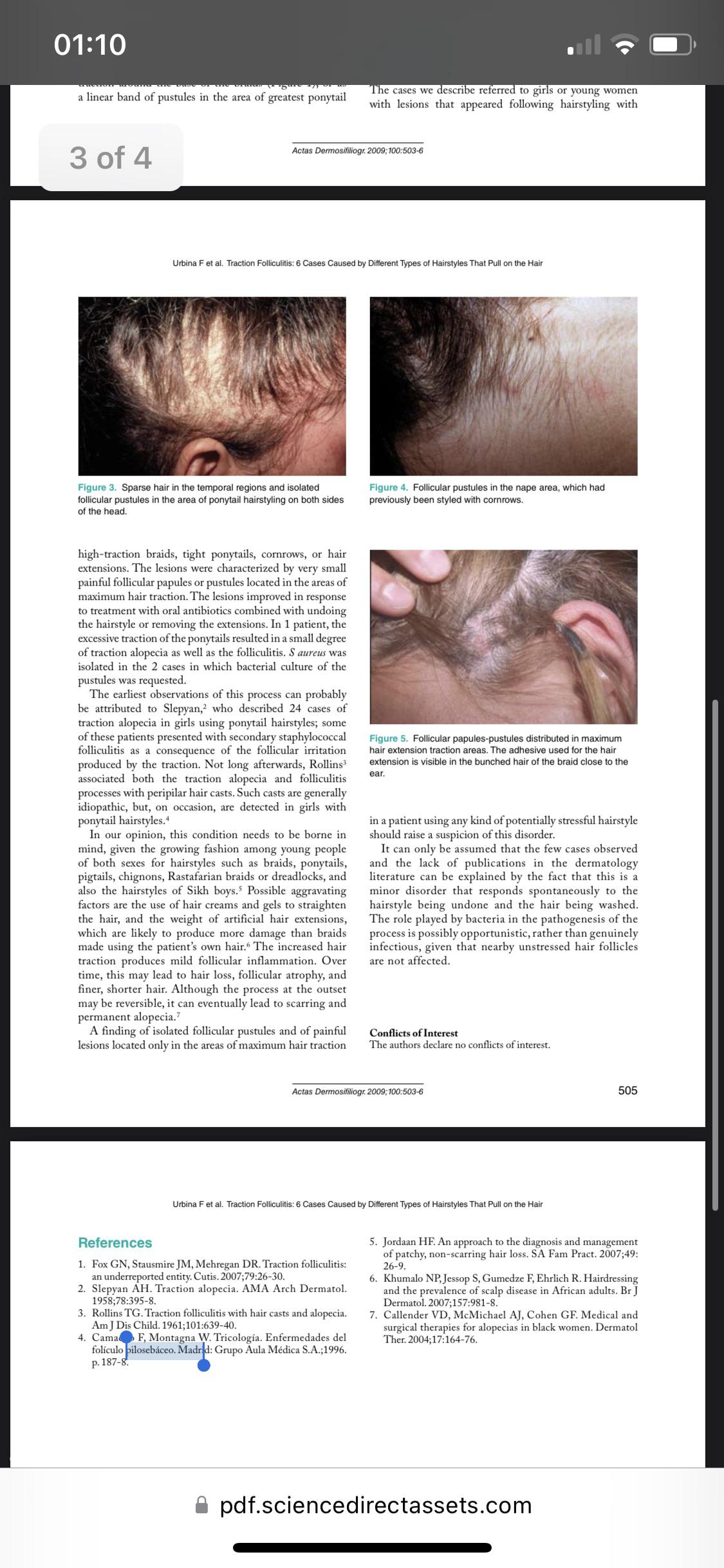 Traction Folliculitis | Scrolller