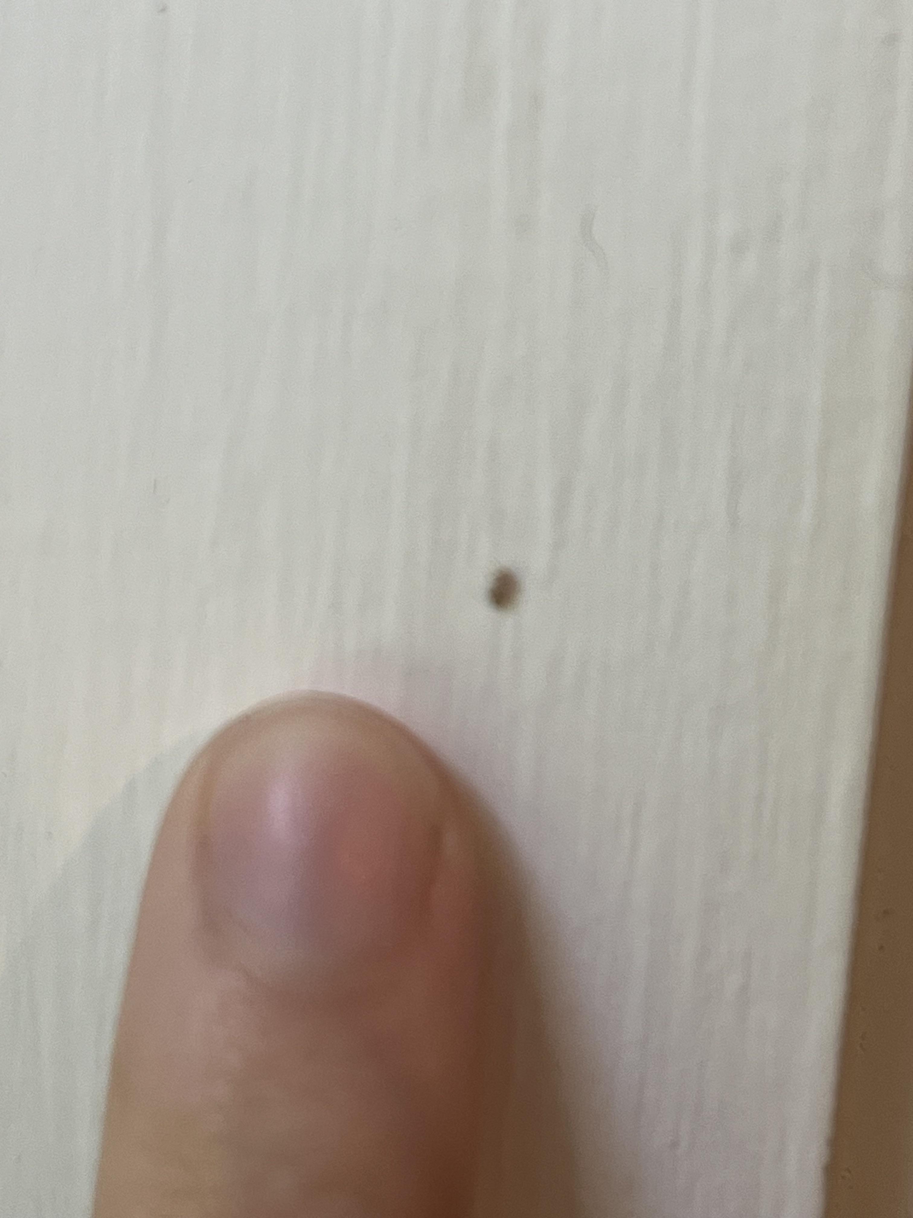 Bed bug? | Scrolller