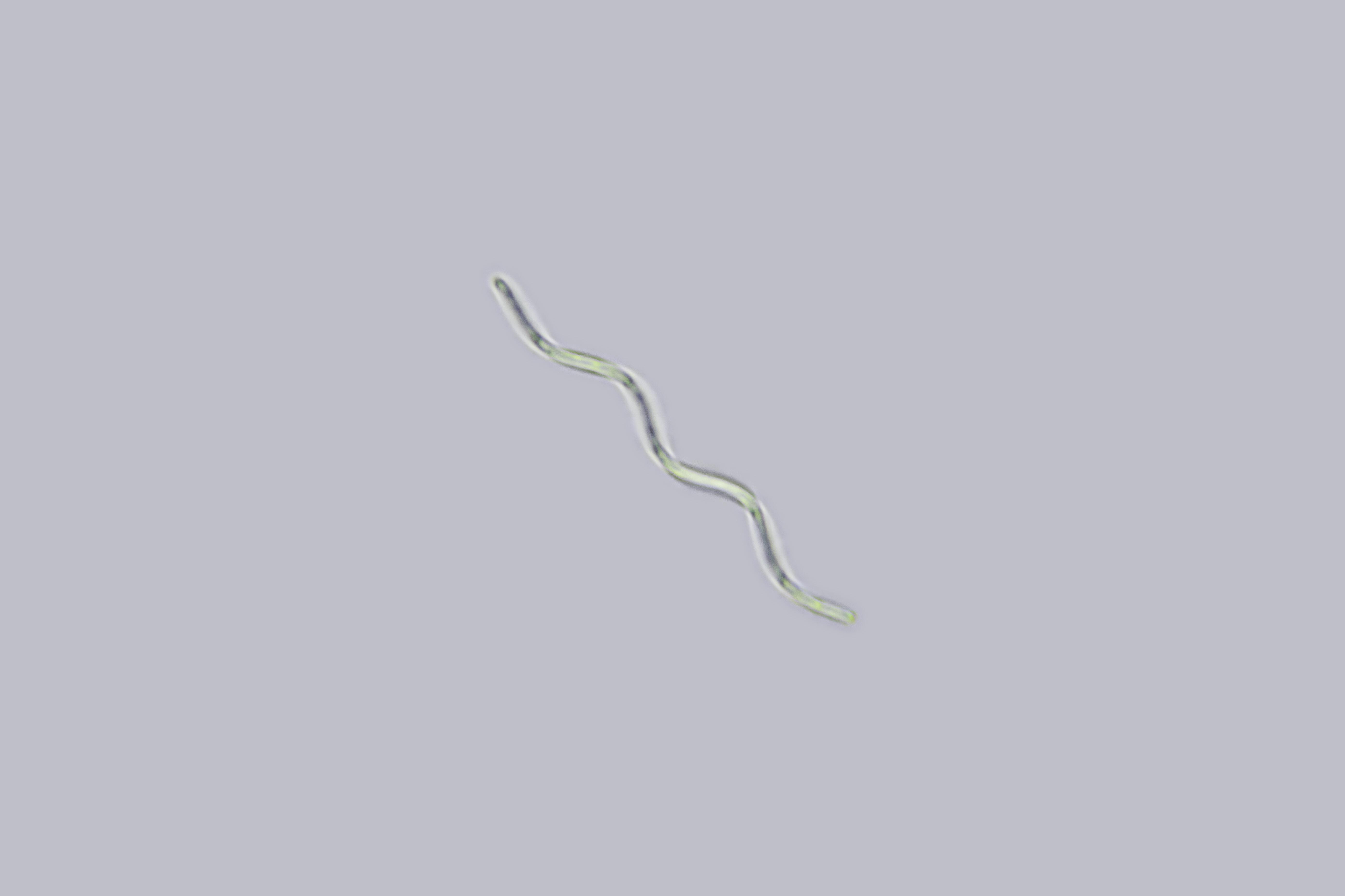 A bacteria i photographed at 1000x | Scrolller