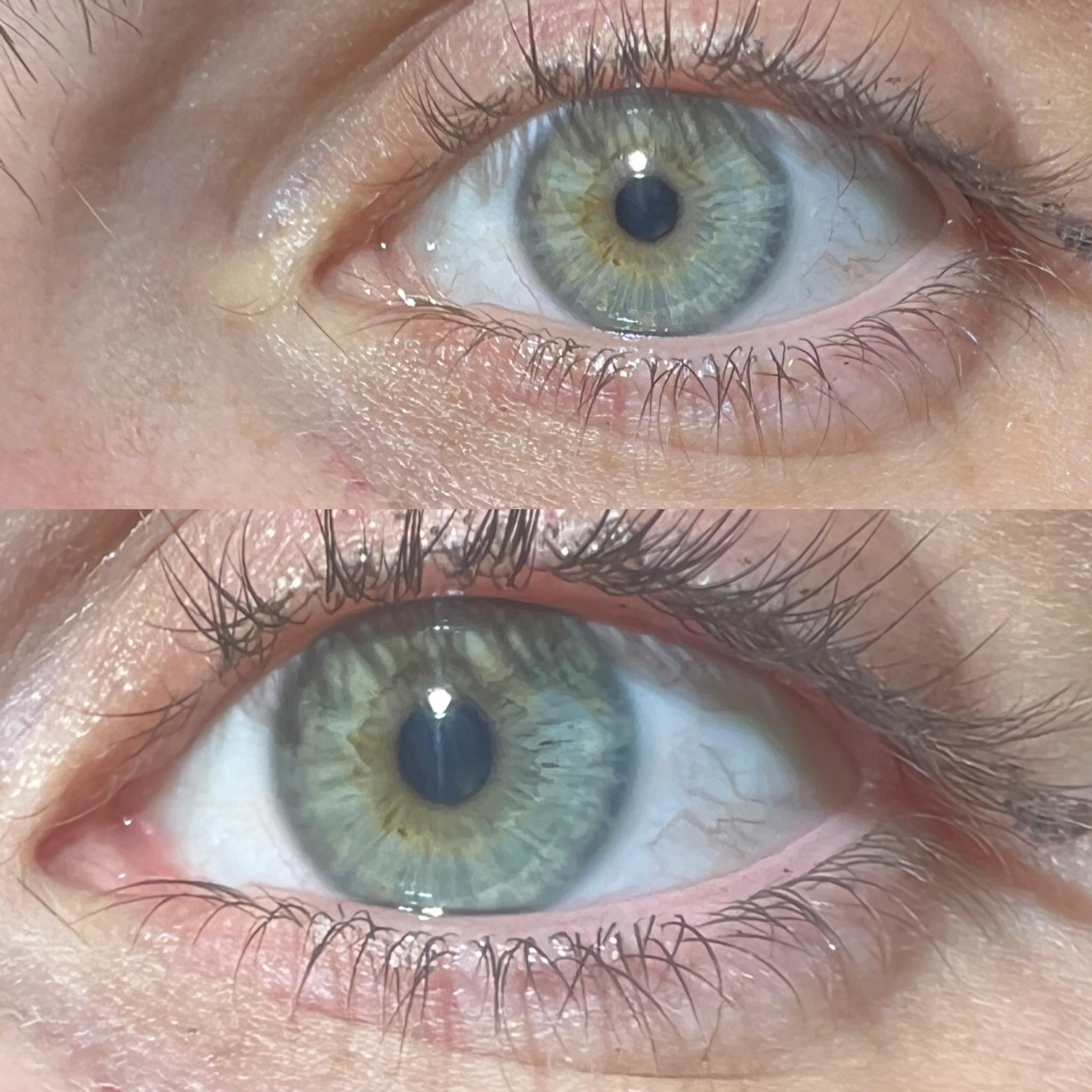 Green? Blue? Hazel?! | Scrolller