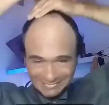 Fixing a common problem | Scrolller