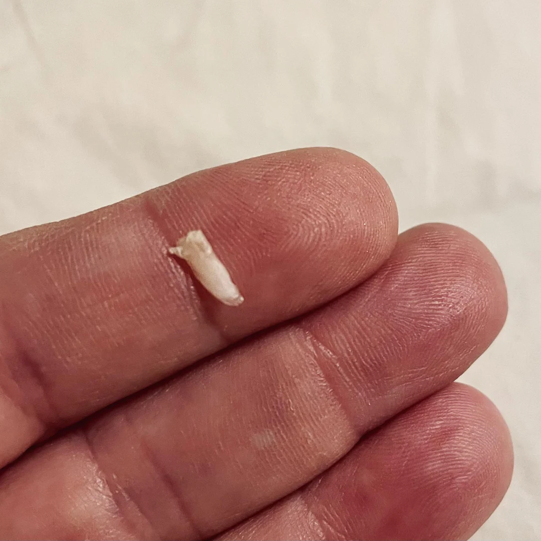 Popped out the extra sliver of toenail tonight | Scrolller