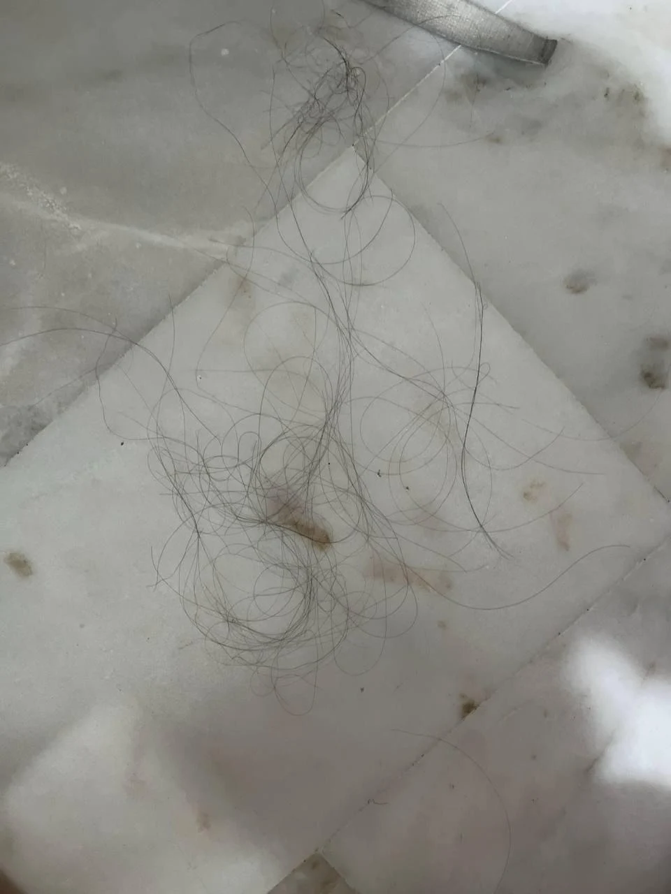 Hair loss problems | Scrolller