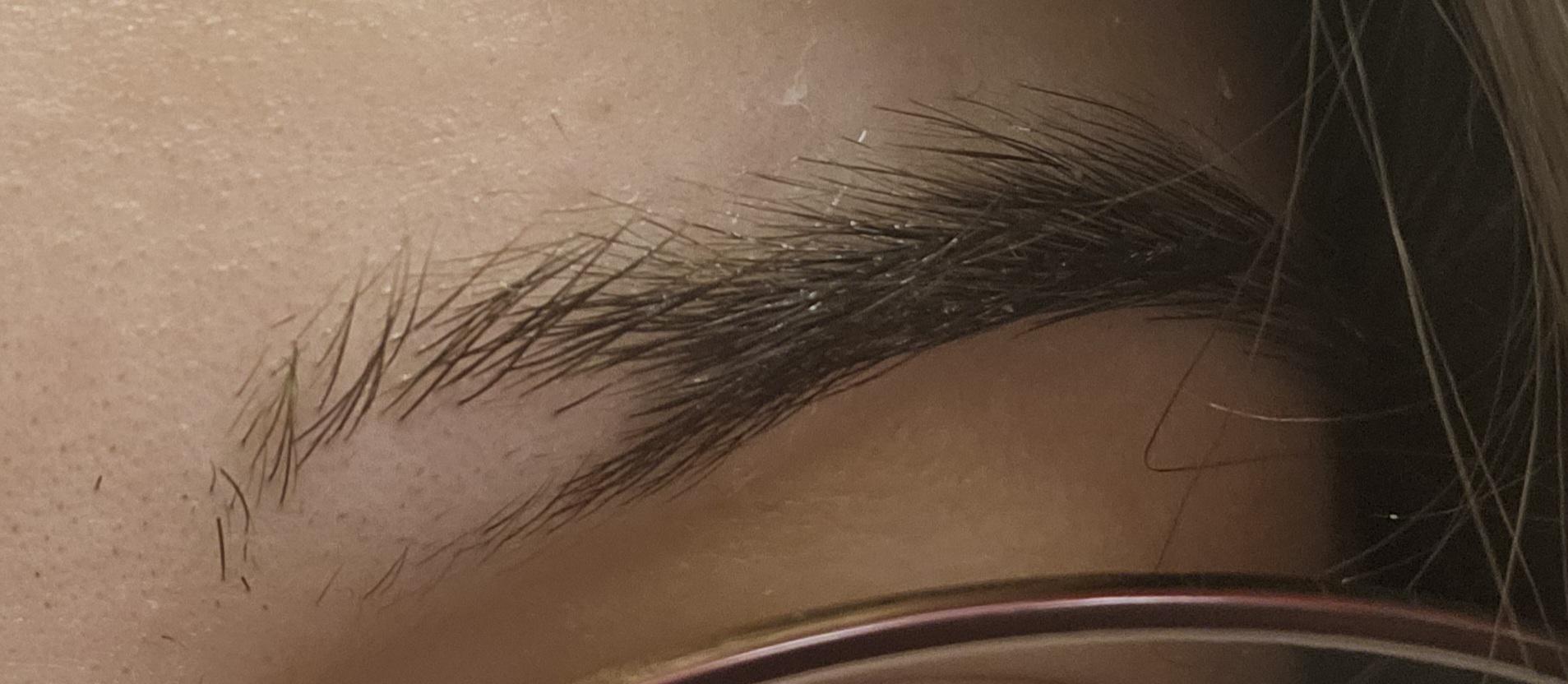 Gap in eyebrow due to wax | Scrolller