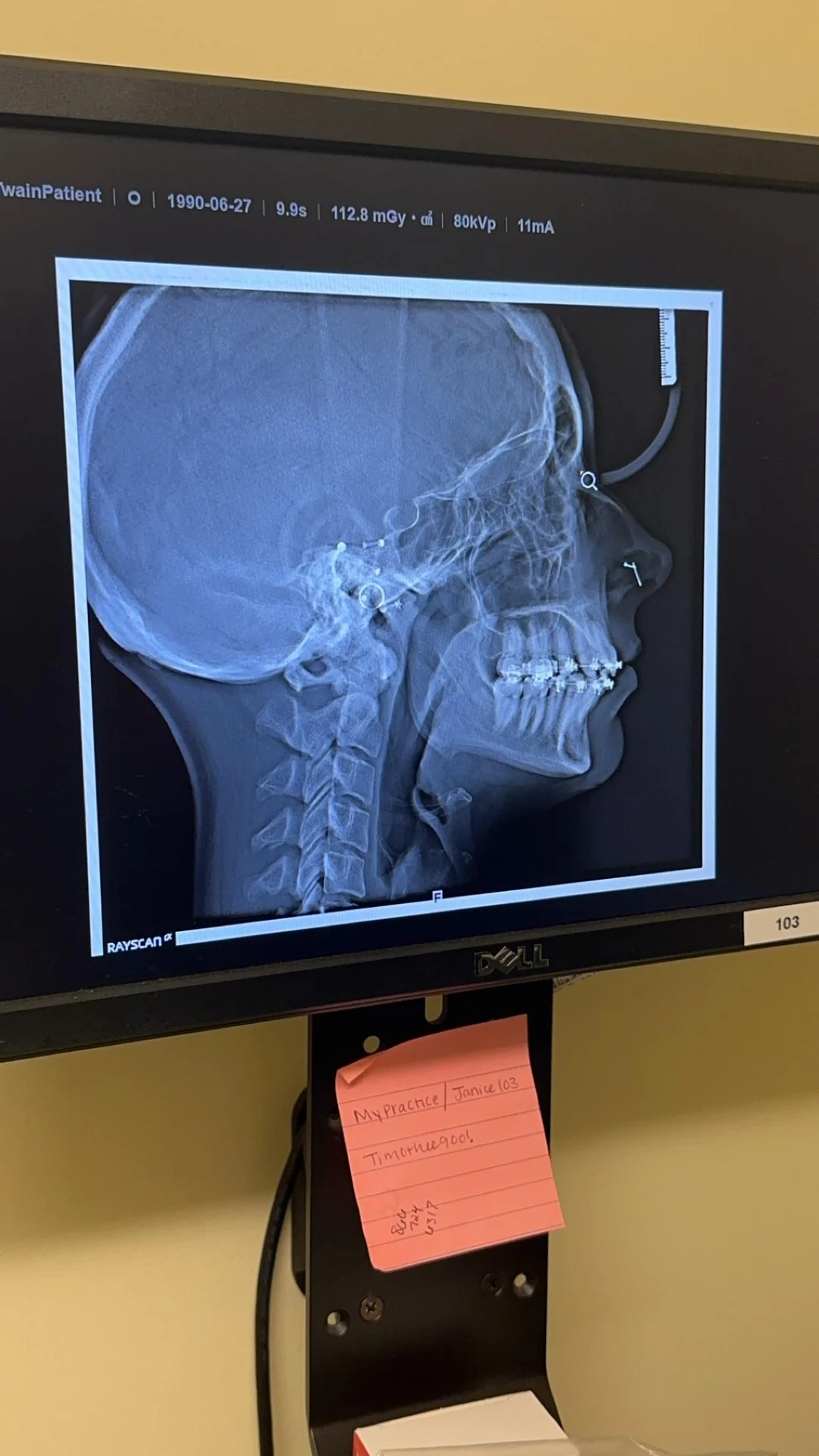 Extraction advice | Scrolller