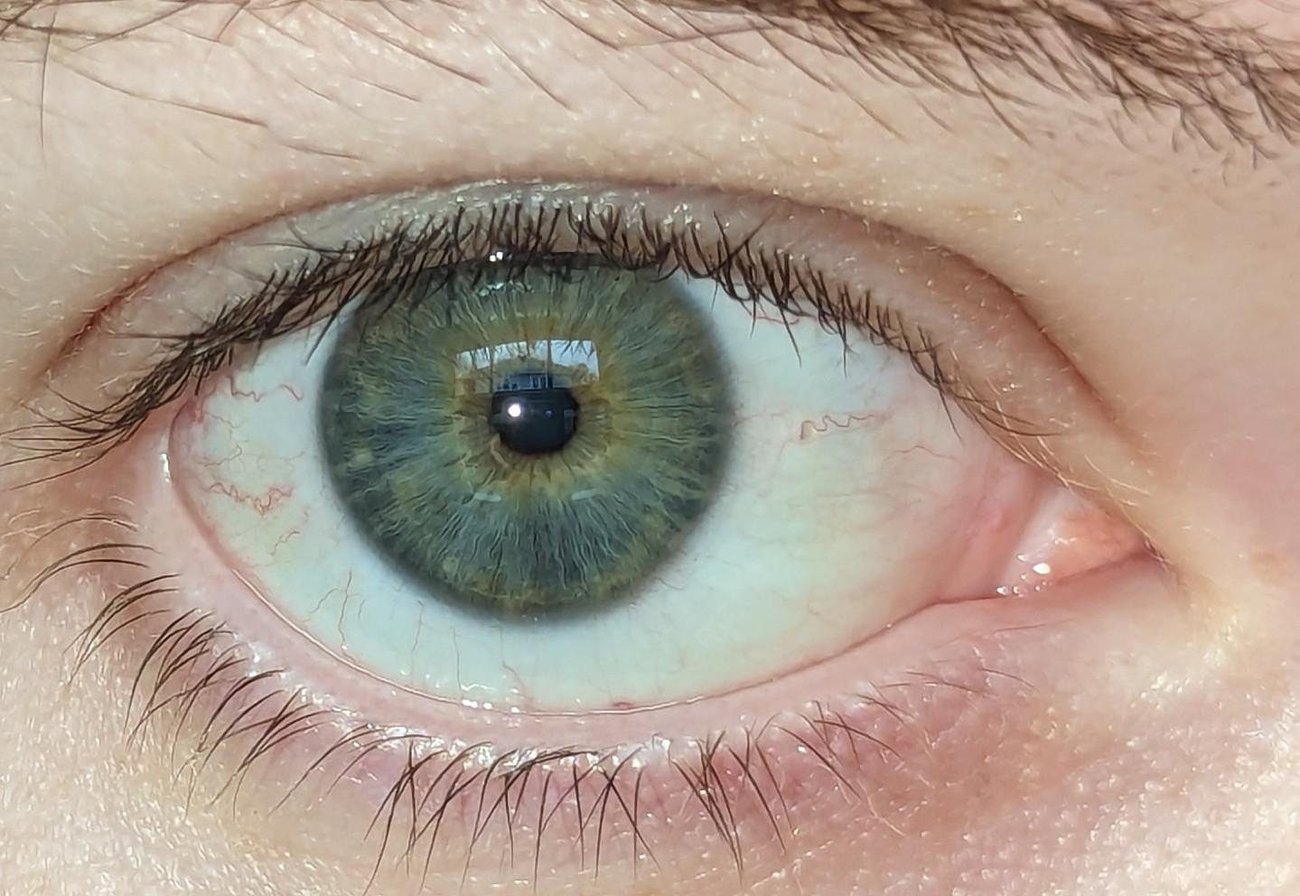 I've always said my eyes are "hazel?" but was curious as to what the experts think.. | Scrolller