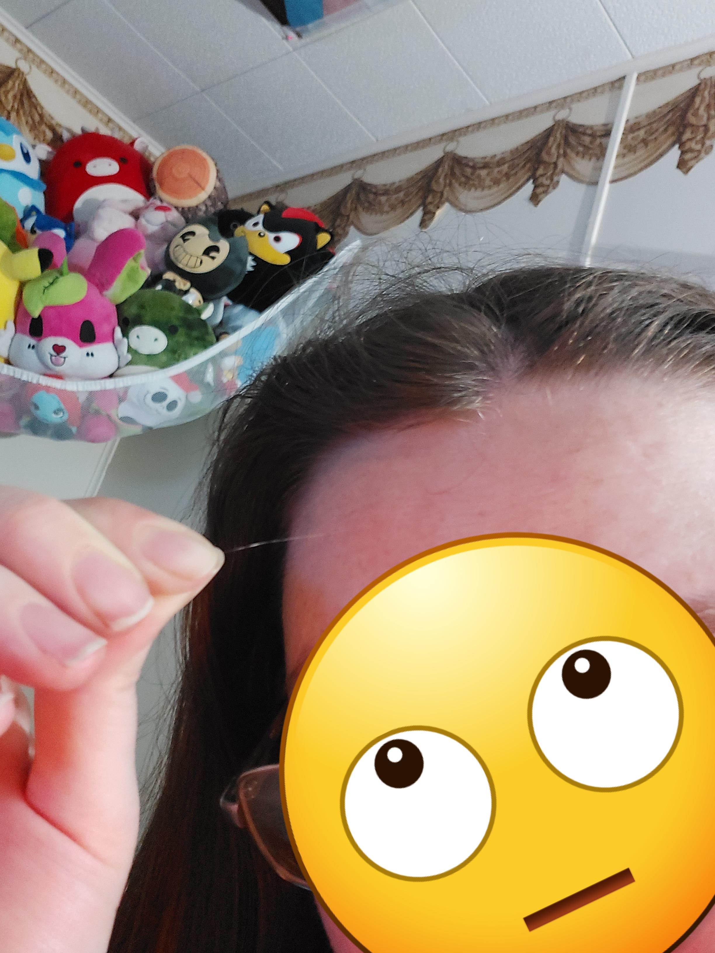 I have one, long, white hair that repeatedly grows near the center of my forehead. | Scrolller