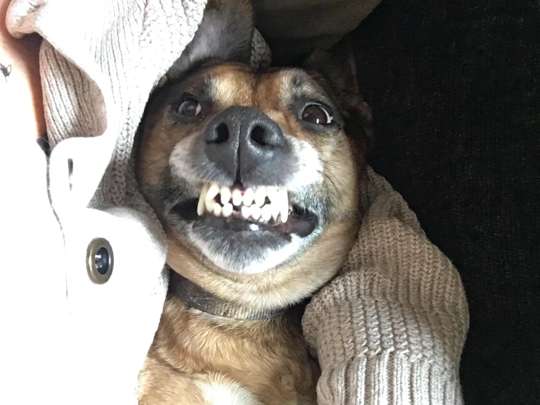 Braces and a fake tooth go on tomorrow 🦷 | Scrolller