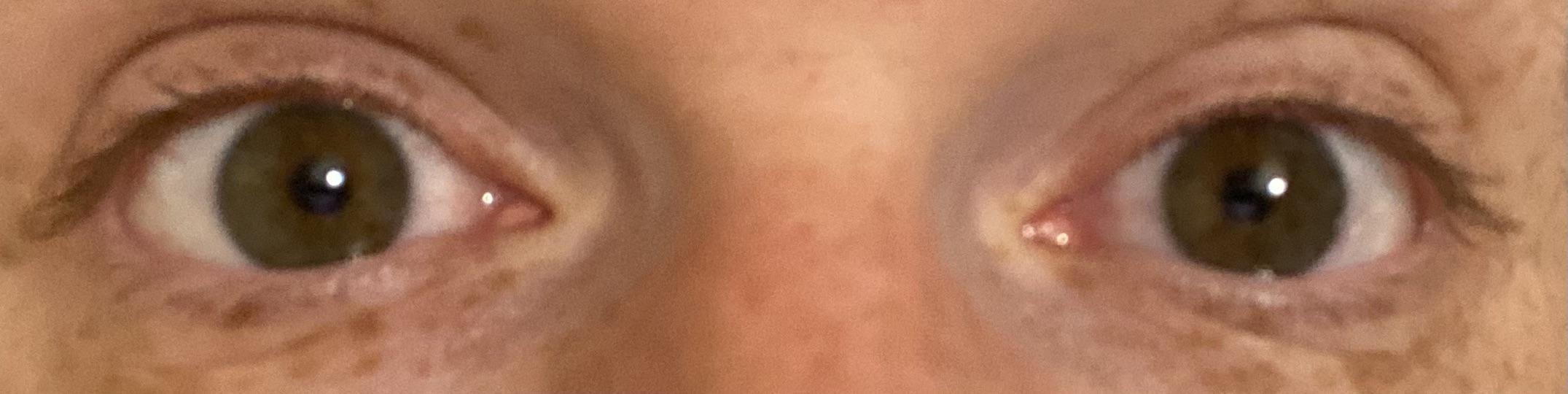 What colour are these? Hazel? | Scrolller