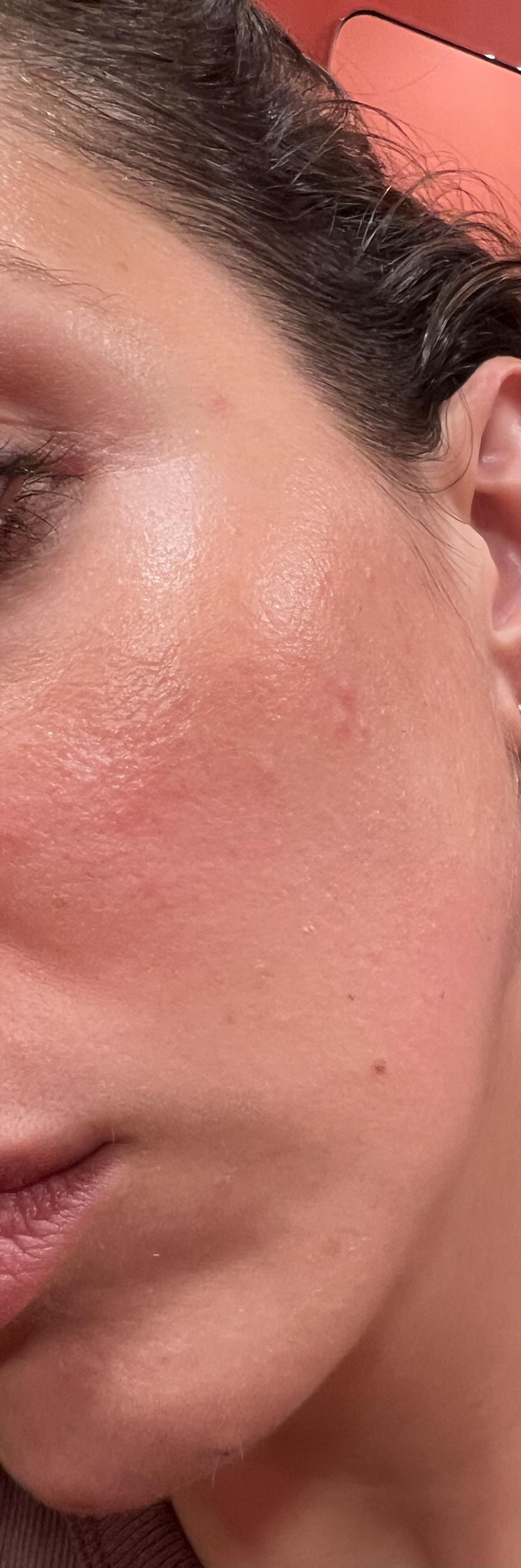 Discover more like 30PlusSkinCare: Skin texture causes and Related Content | Scrolller