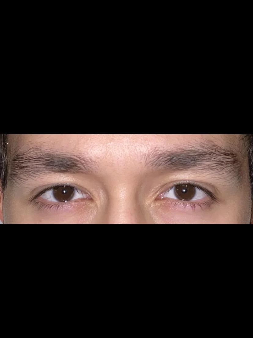 How to grow eyebrows without minox? | Scrolller