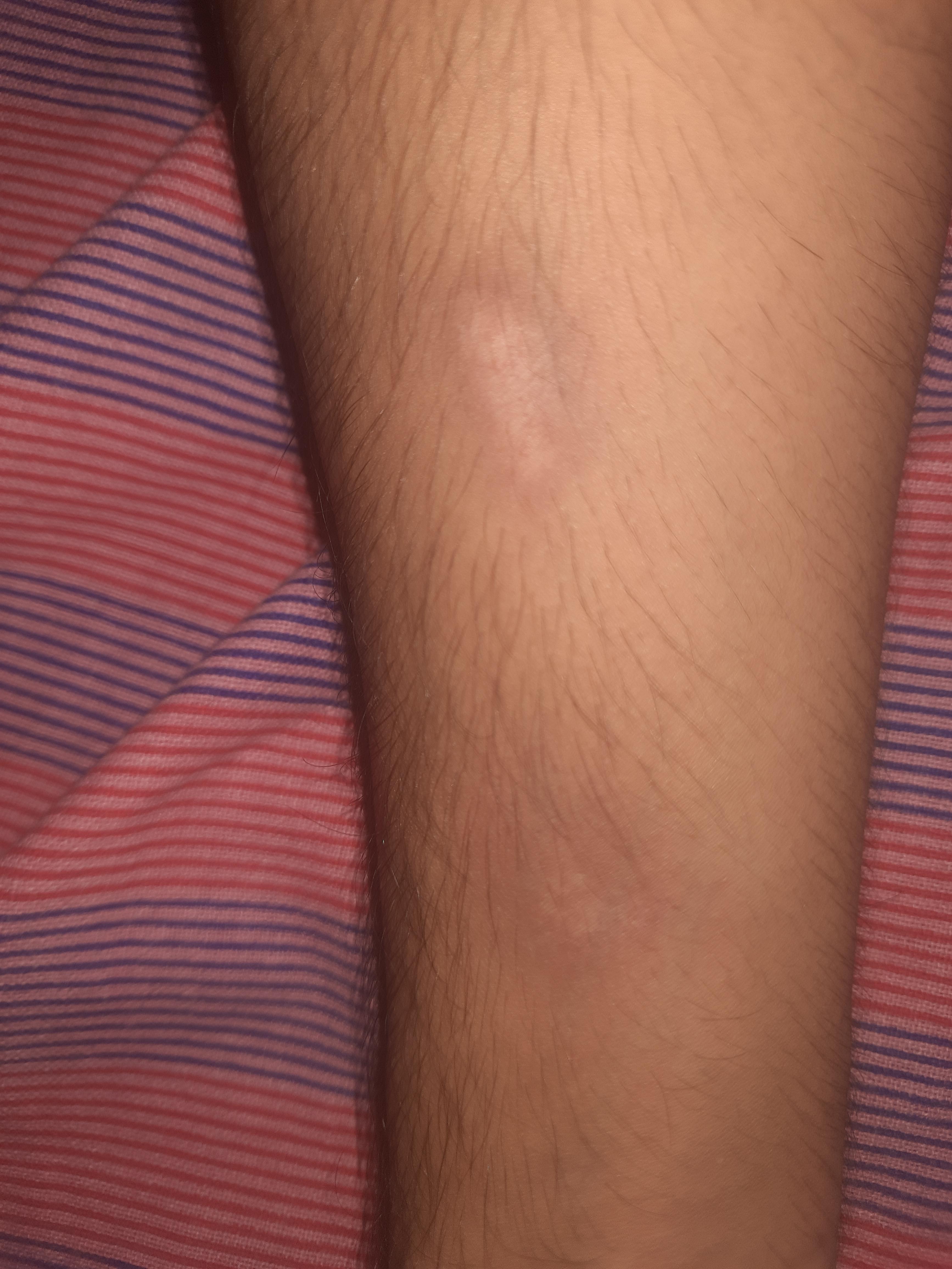 Weird spot on hand | Scrolller