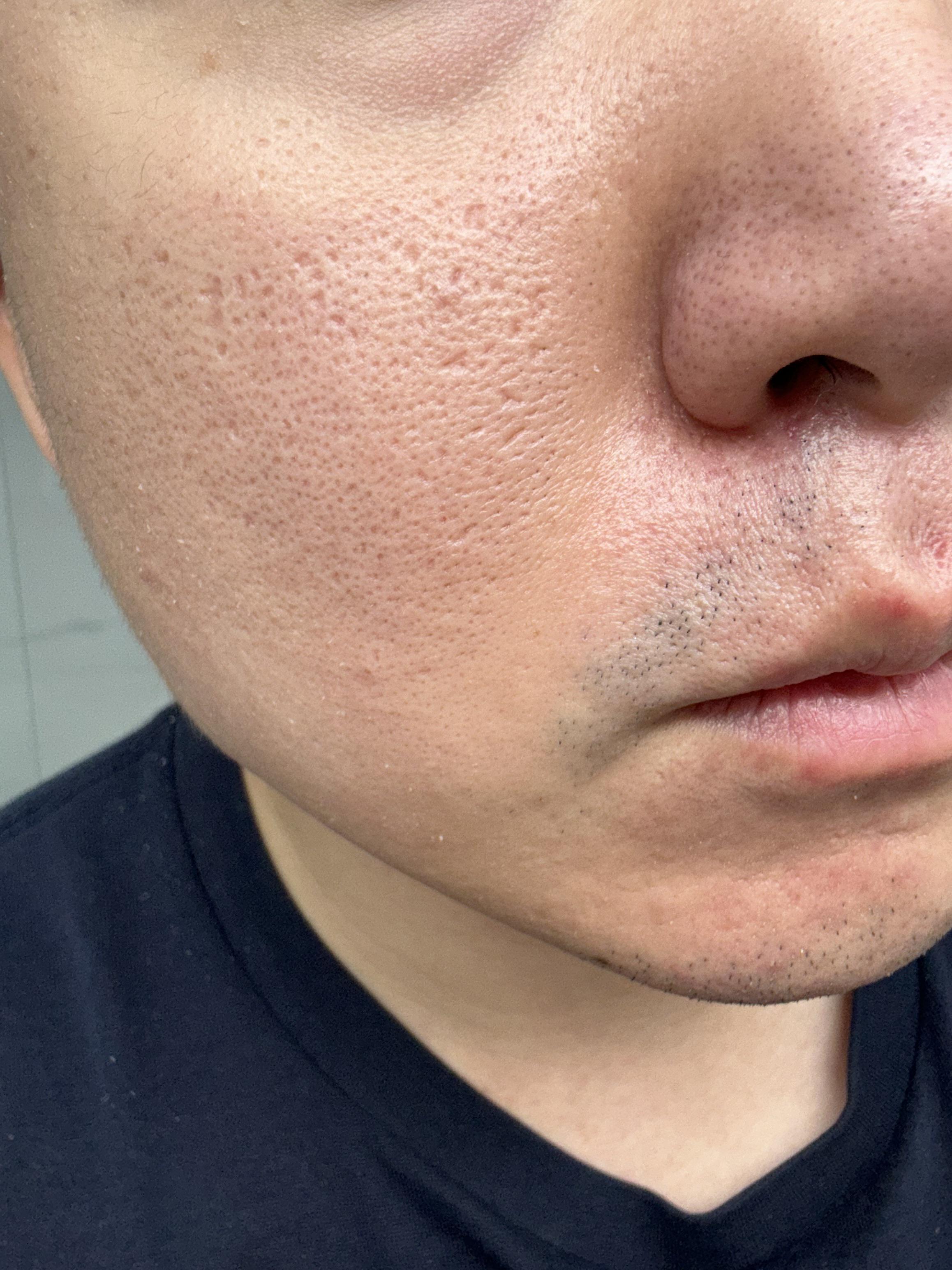 Does this treatment sound correct? | Scrolller