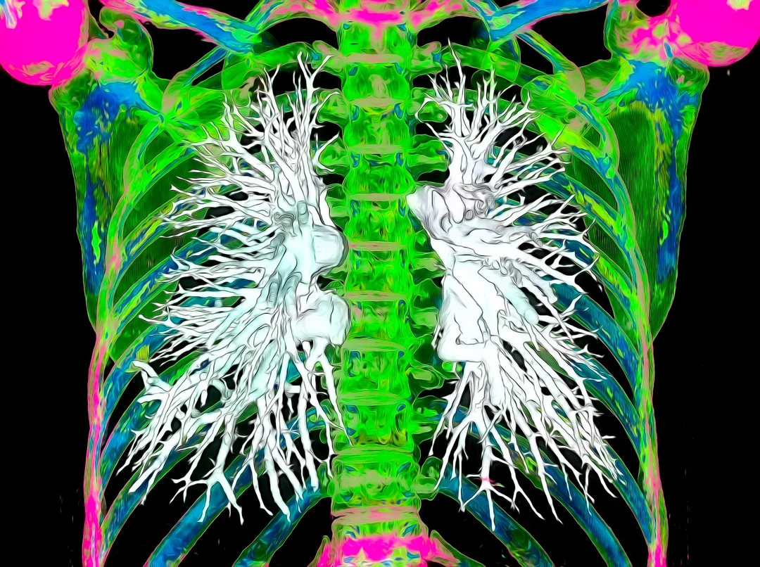 CT 3d lungs , Me, Digital, 2022 | Scrolller