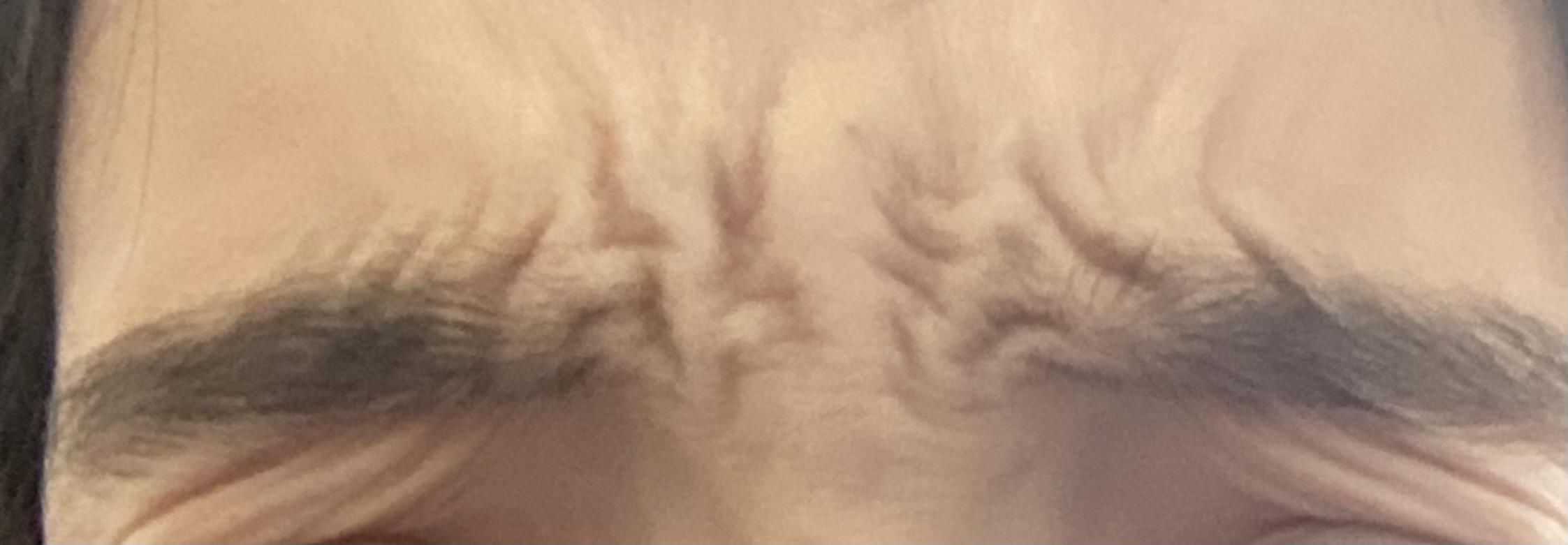 What’s with my frown lines, and why are they so unique? | Scrolller