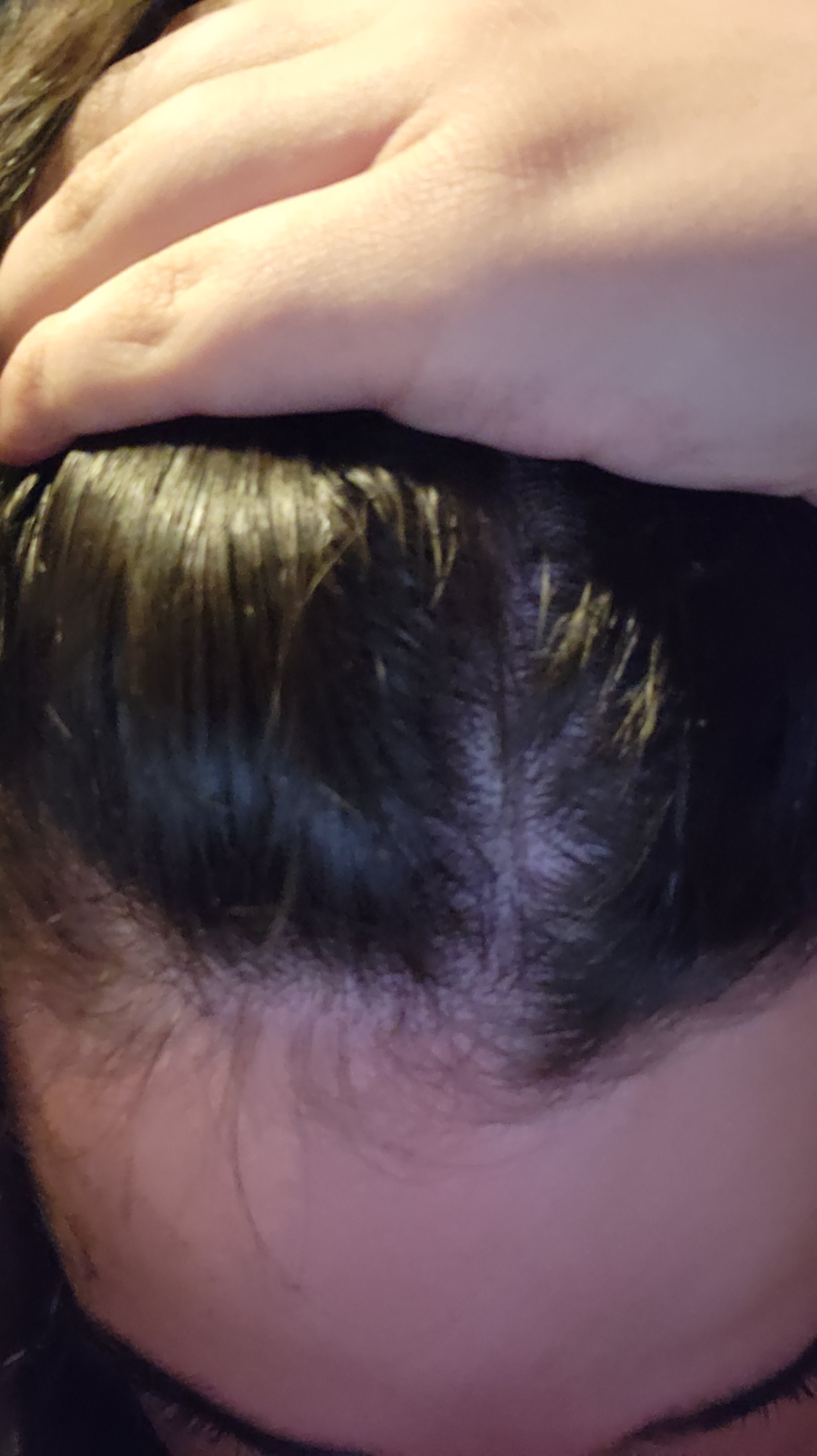 Hey is this male pattern baldness | Scrolller