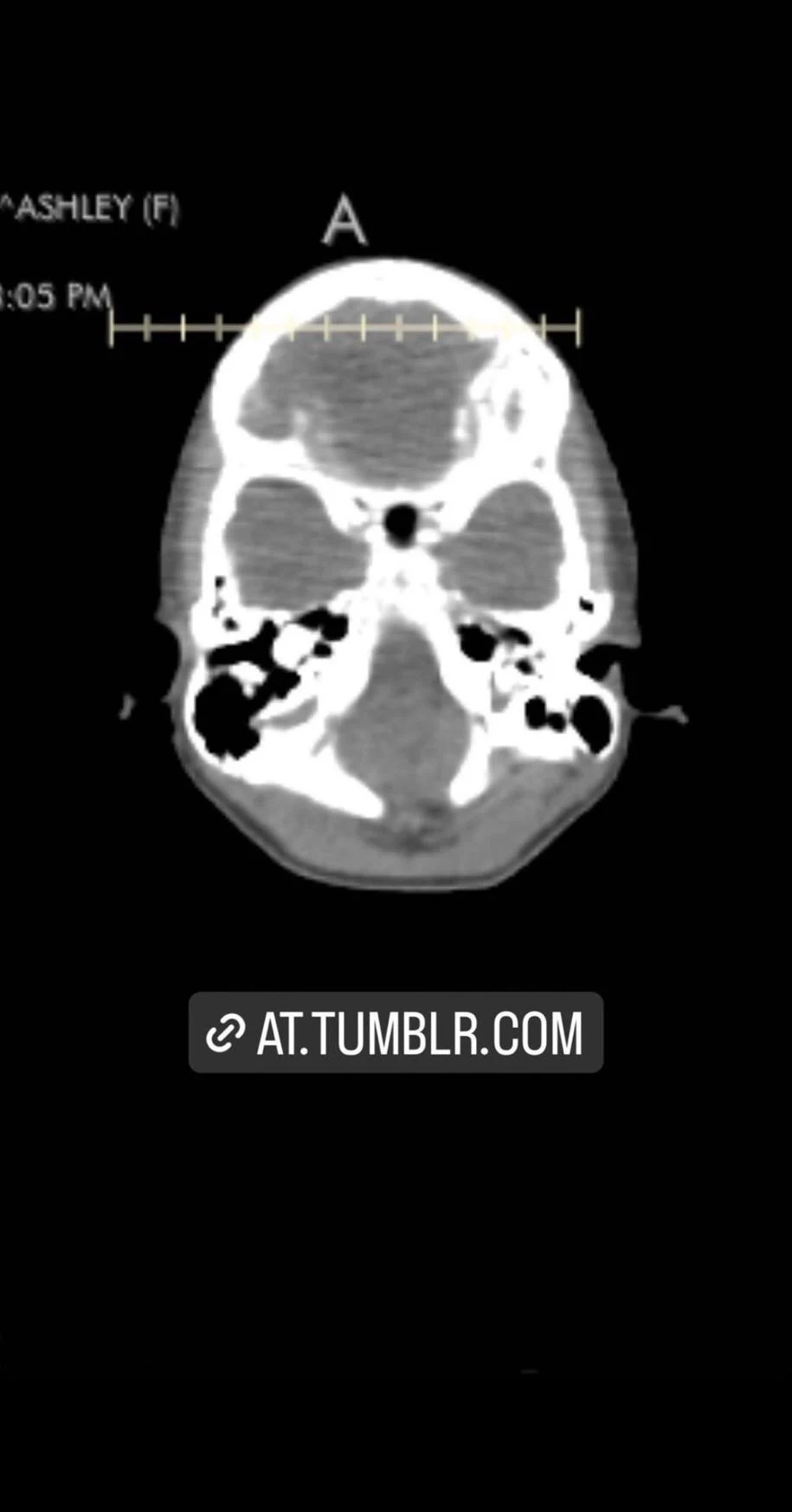 And at first, it was my brain | Scrolller