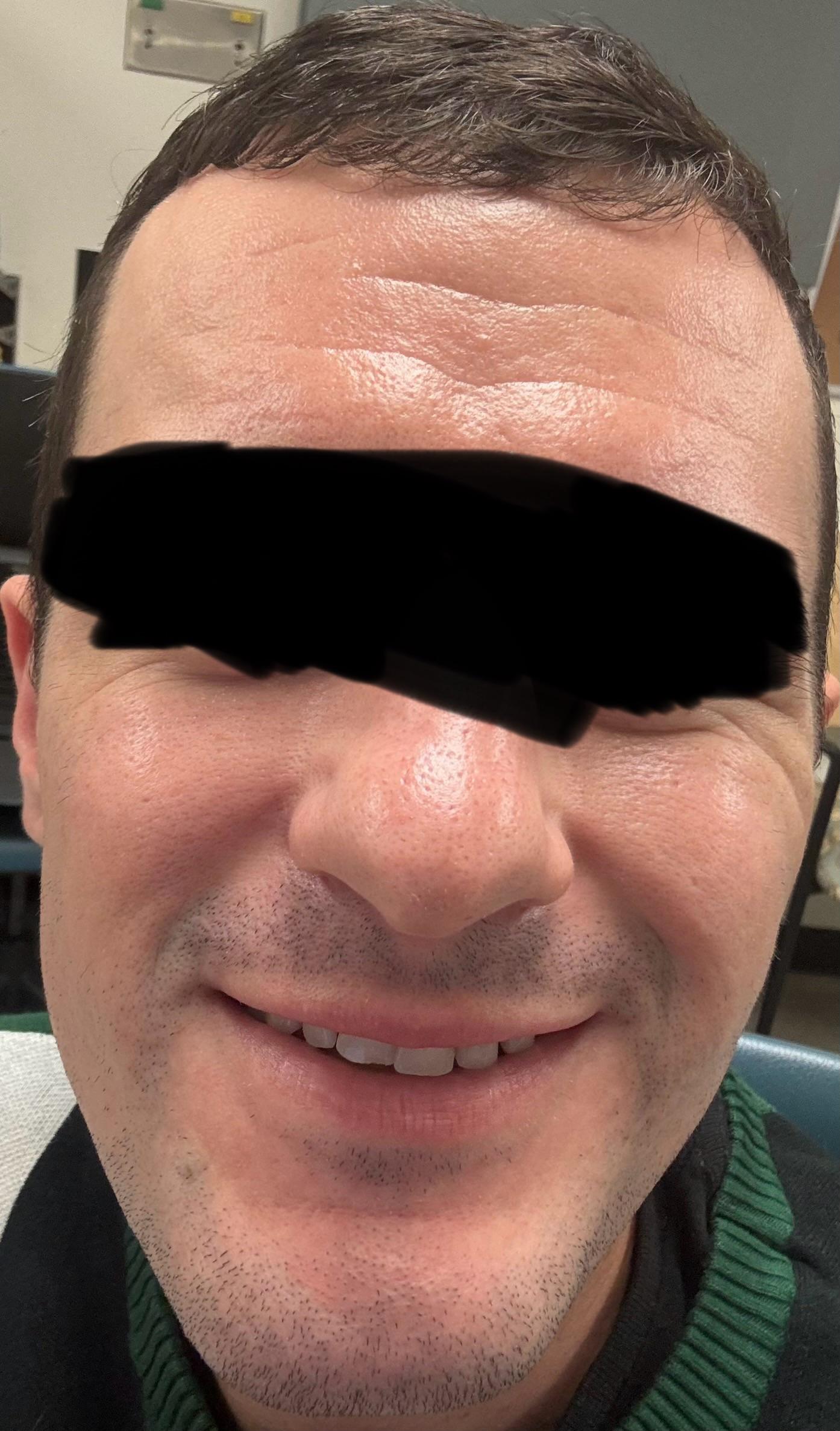 Very visible Forehand lines at 27 | Scrolller