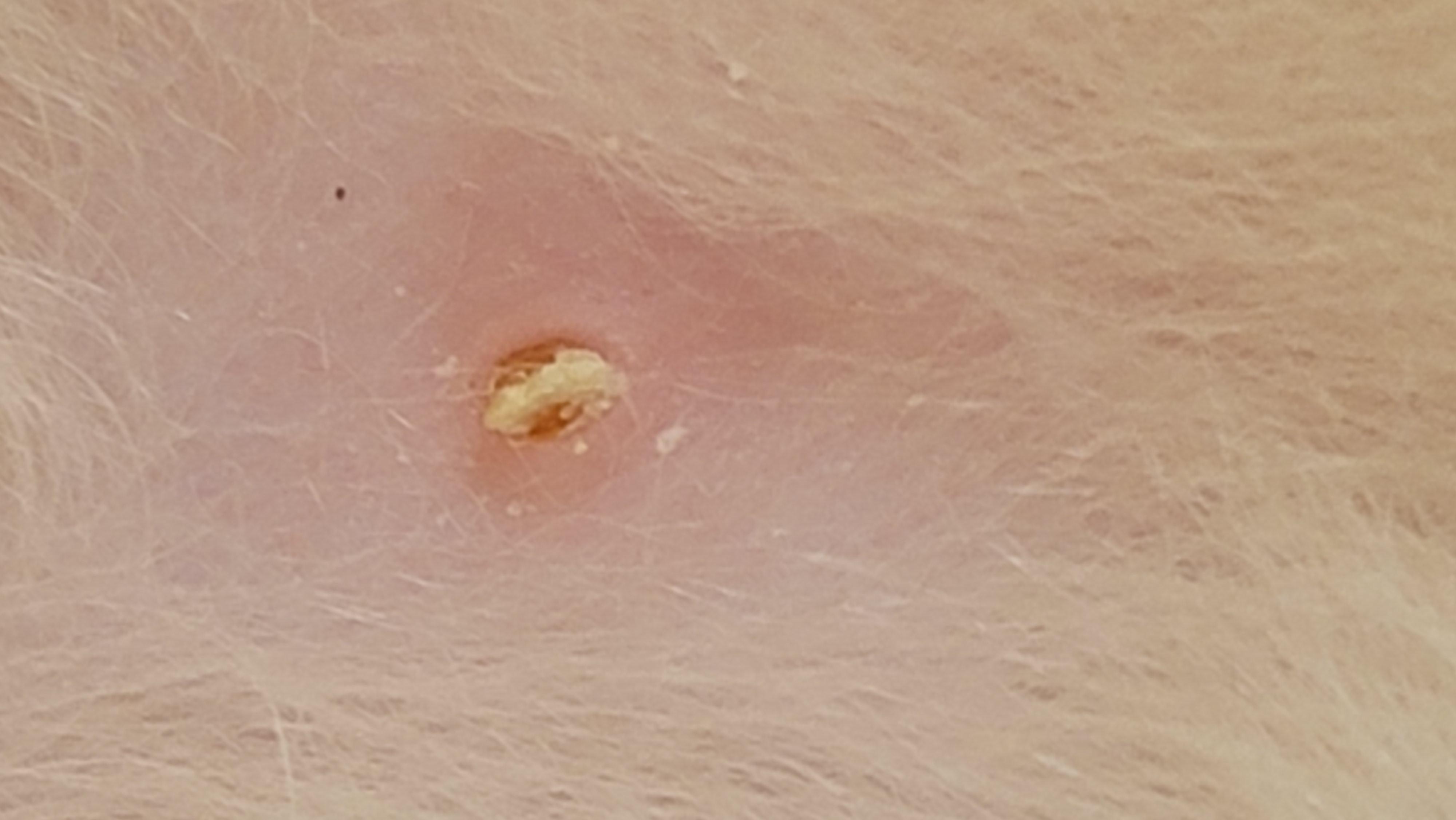 What is this on my cats stomach? | Scrolller