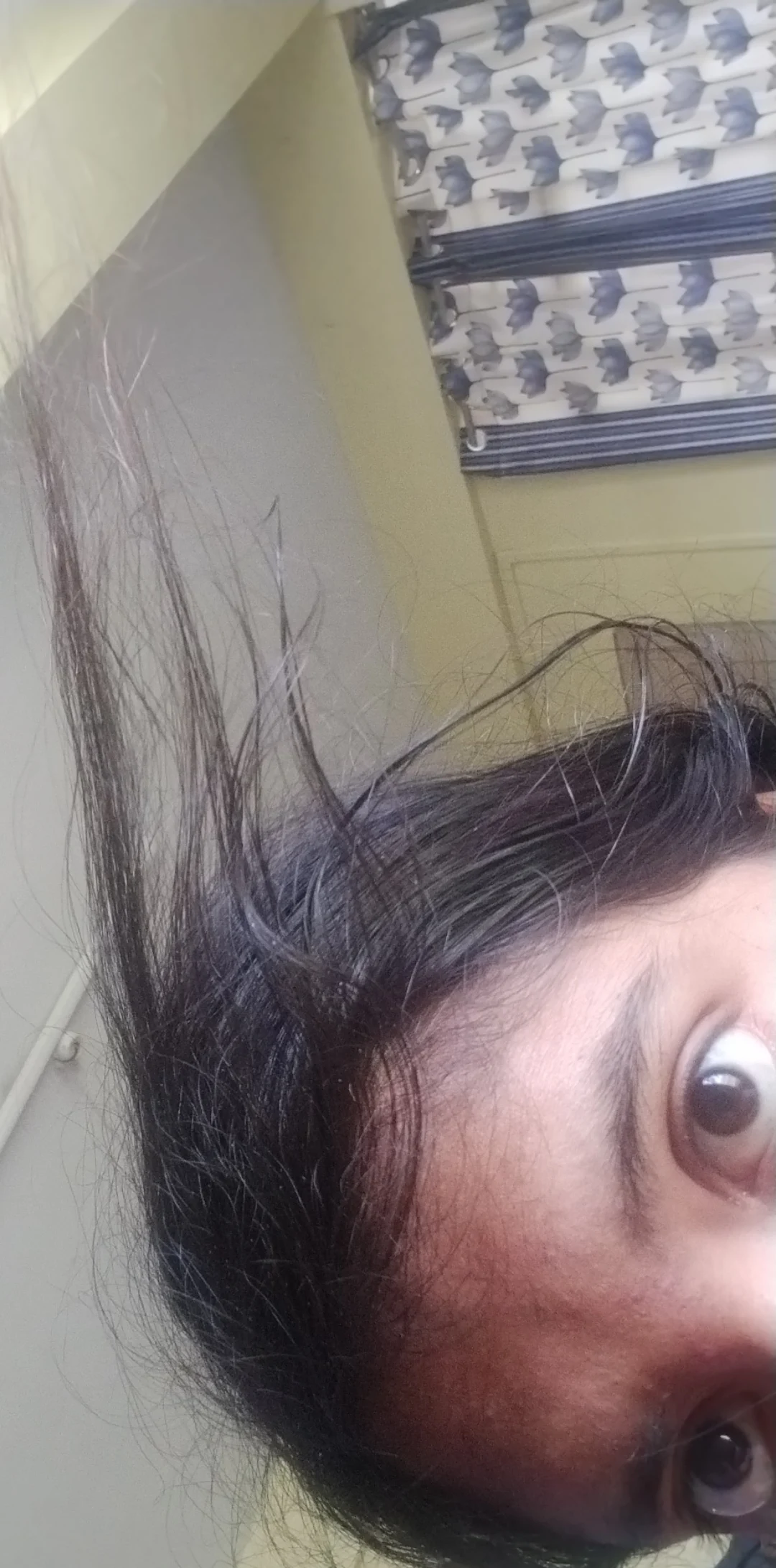 Hair damage | Scrolller