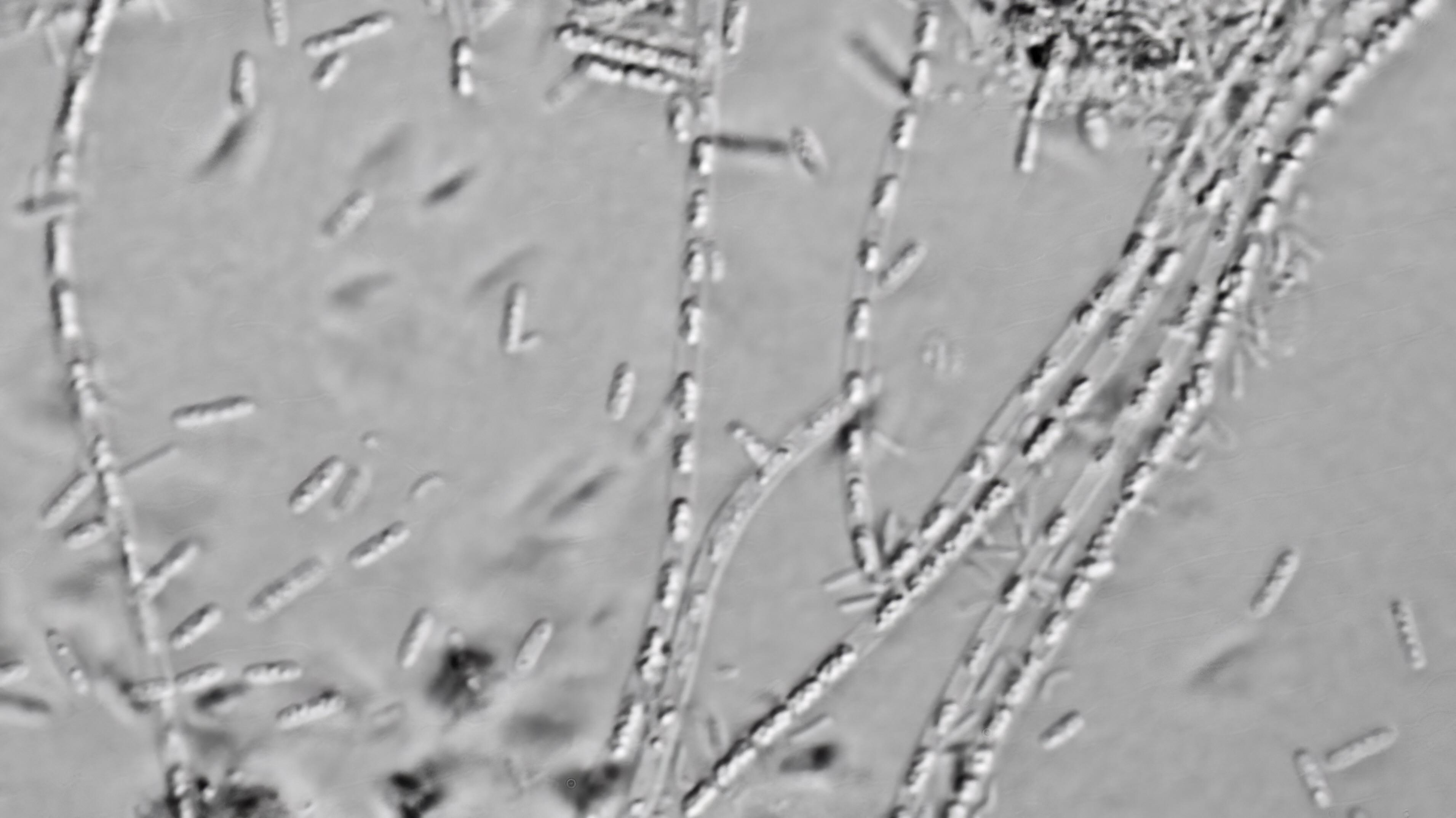 Bacteria highway | Scrolller