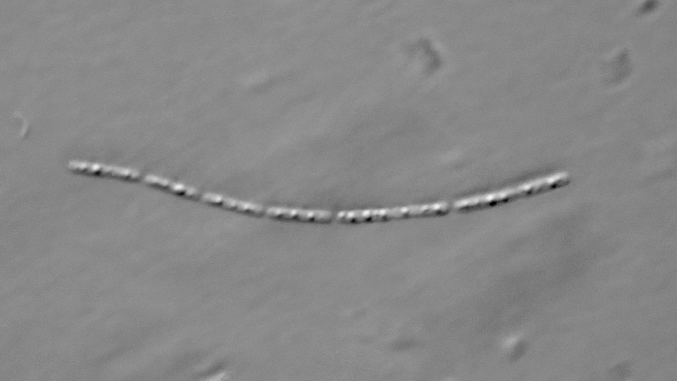 Bacteria i photographed | Scrolller