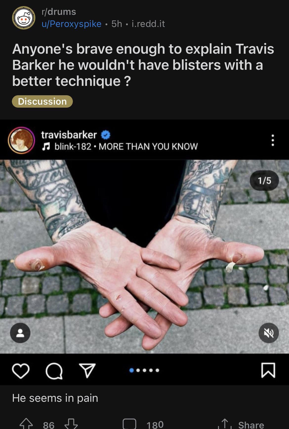 Technique bro, probably has bad toan too. | Scrolller