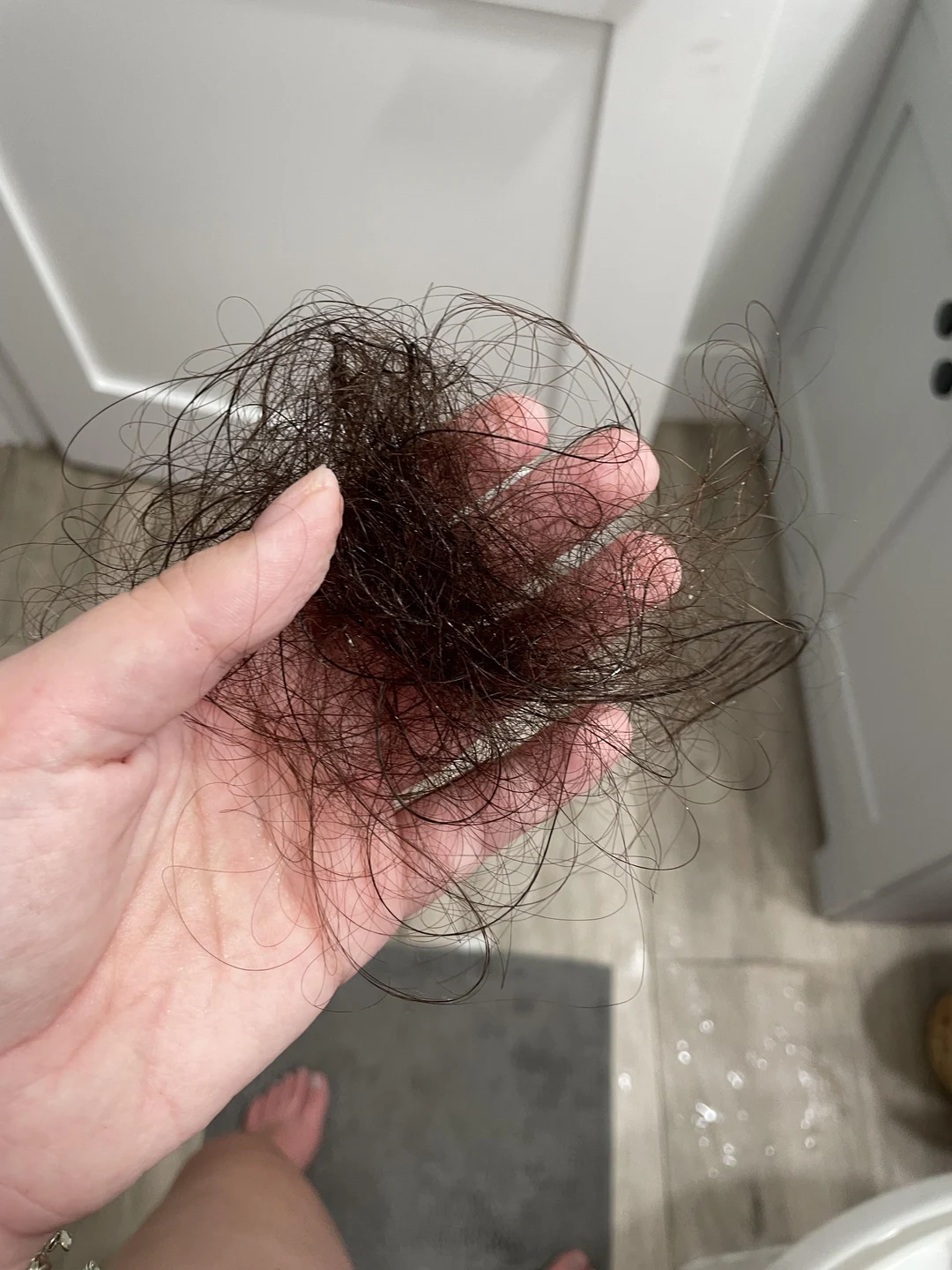 Normal shedding? | Scrolller